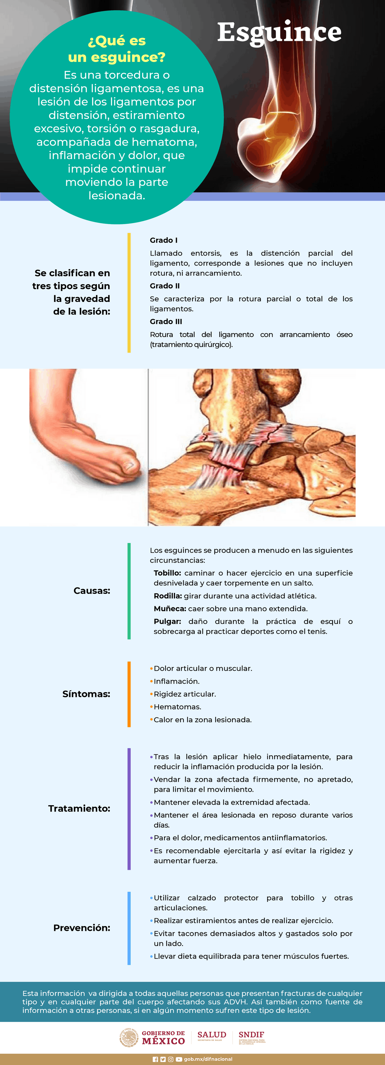 Esguince: Clasificación, Síntomas y Tratamiento | Diapositivas de ...