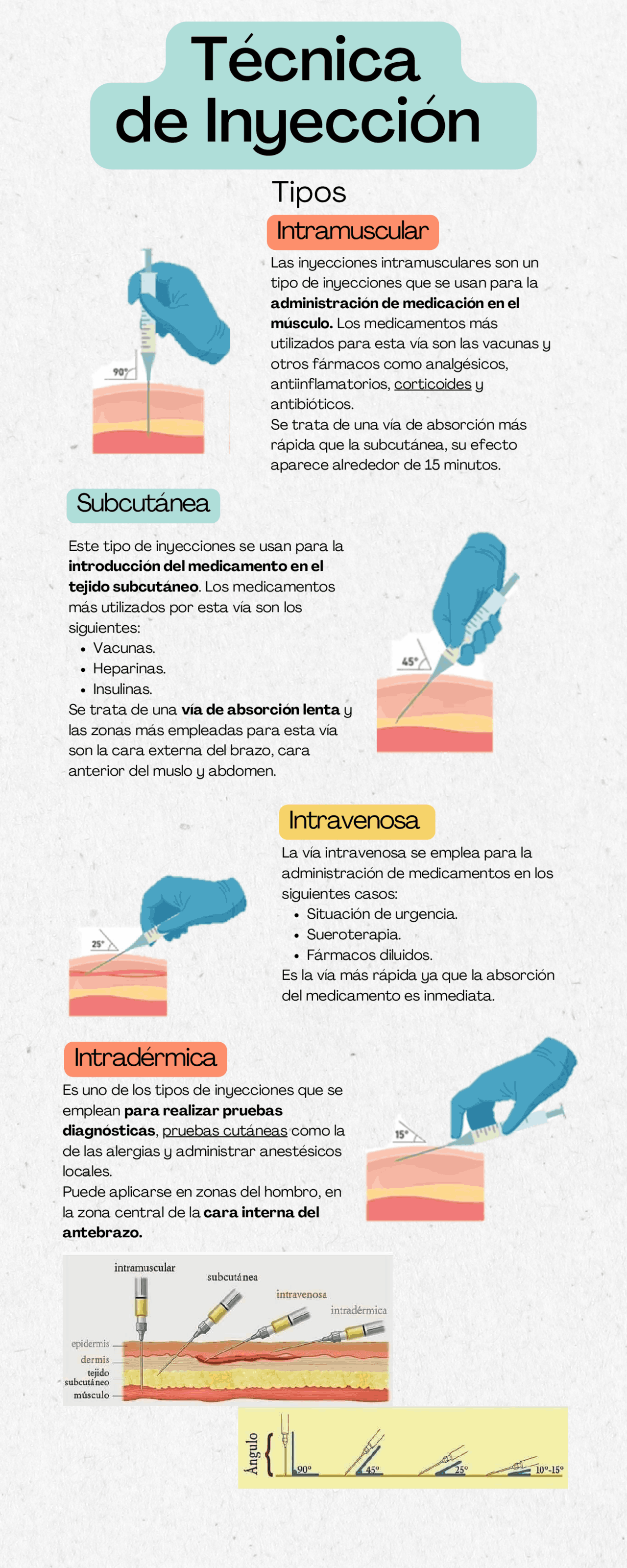 Tecnica de Inyeccion | Apuntes de Enfermería Clínica | Docsity