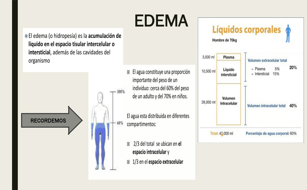 Edema inflamación y dolor | Diapositivas de Fisiopatología | Docsity