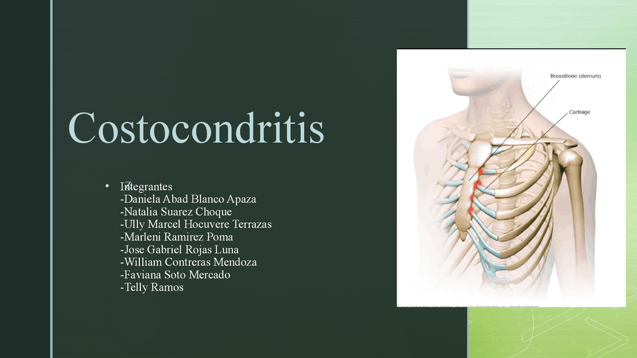 Costocondritis: Causas, Síntomas y Tratamiento de la Inflamación del ...