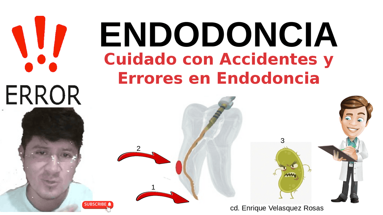 Accidentes y Errores en Endodoncia | Guías, Proyectos, Investigaciones ...