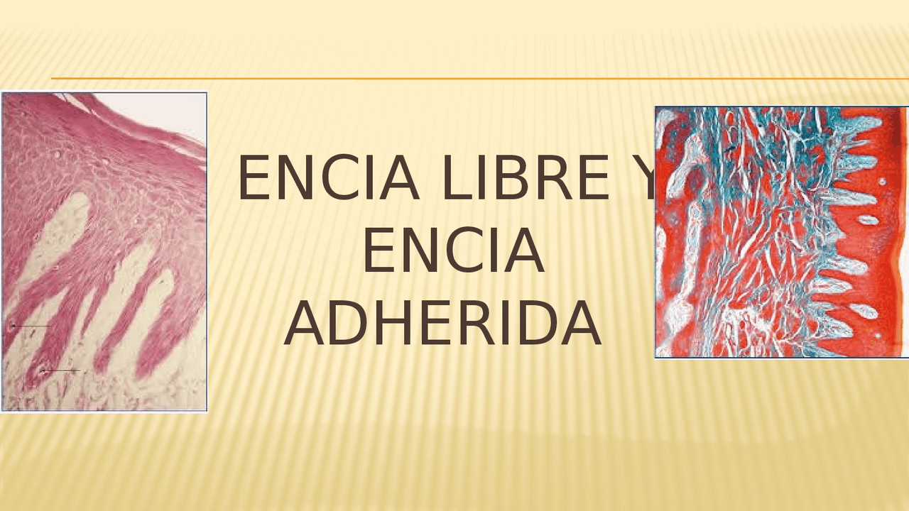 la encia libre y adheridas | Esquemas y mapas conceptuales de ...