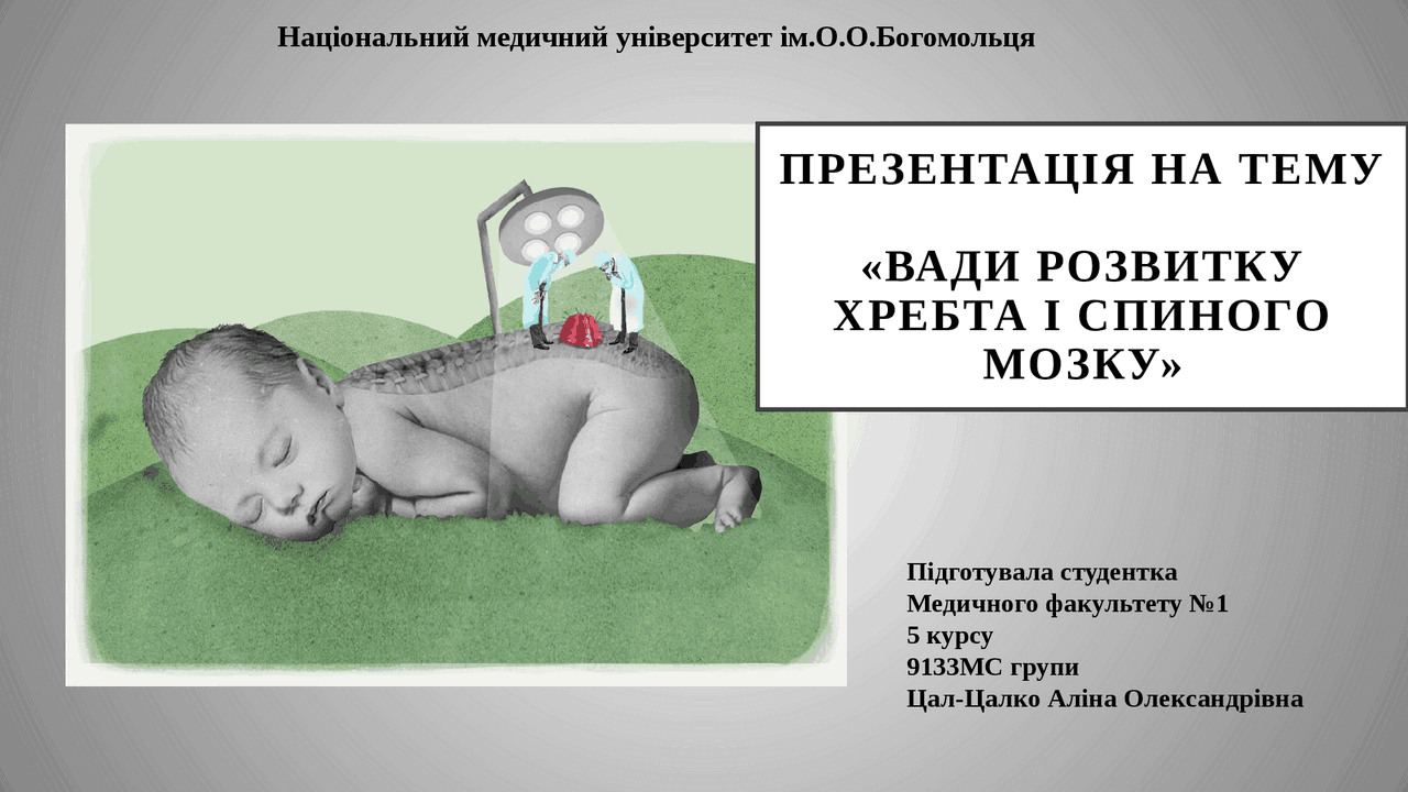 нейрохірургія перезентація "вади розвитку хребта і спиного мозку ...