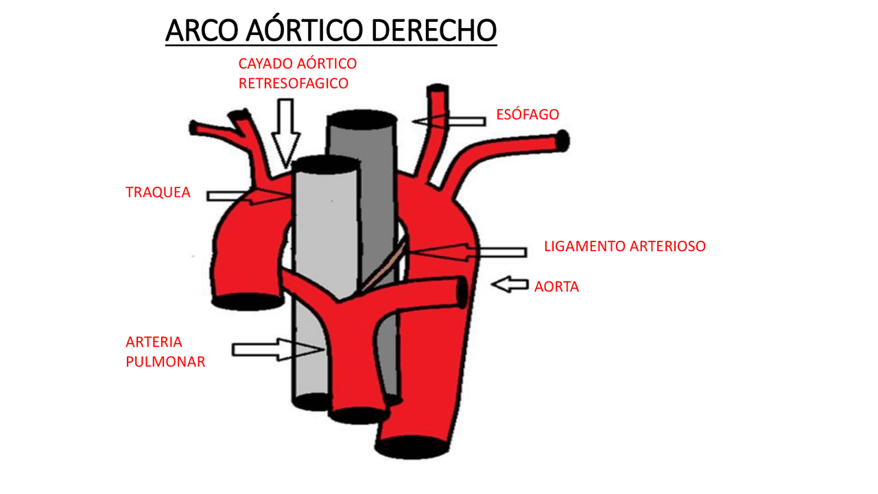 Esquema del arco aórtico derecho, sistema circulatorio del cuerpo ...