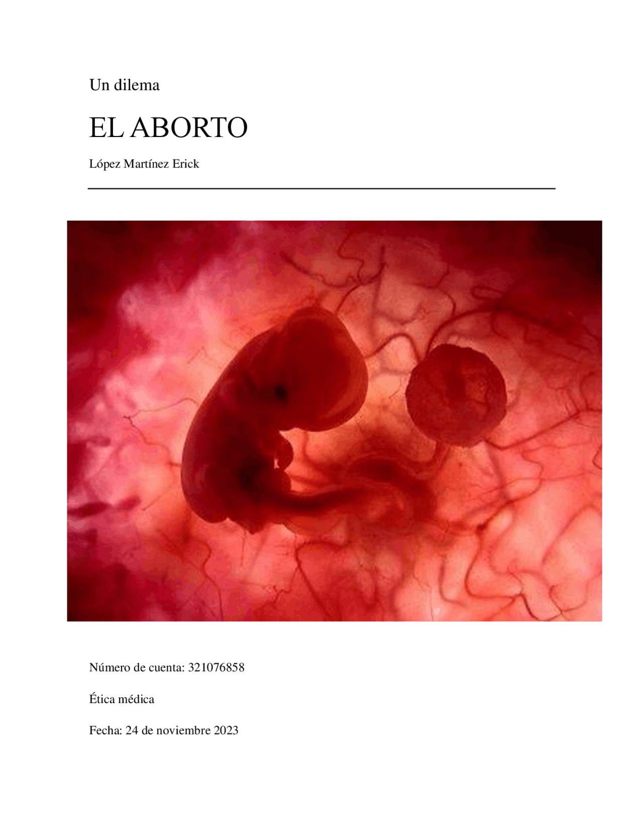 Aborto en México: un dilema ético y médico | Esquemas y mapas conceptuales de Ética Medica | Docsity
