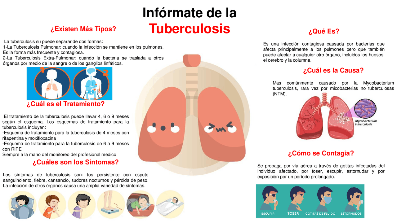 Cartelera de la tuberculosis | Diapositivas de Enfermería | Docsity