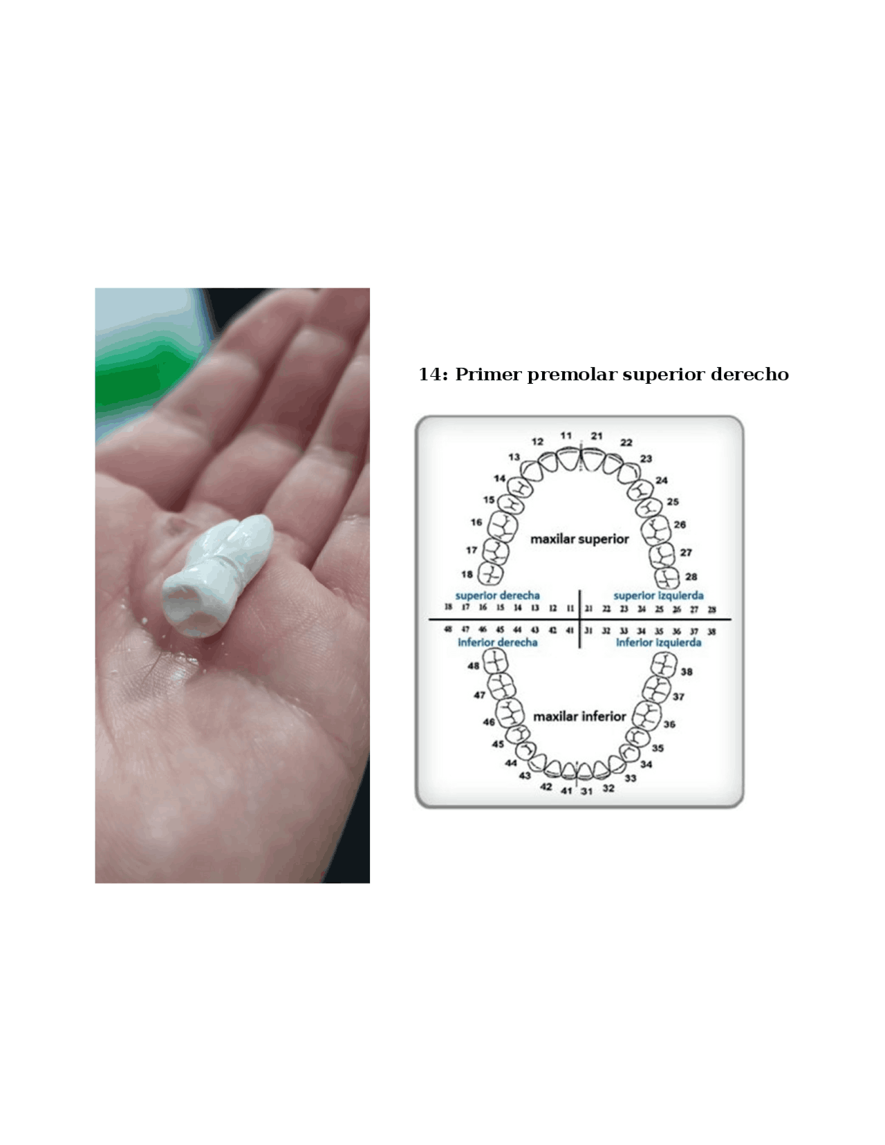 Anatomia dental del primer premolar superior derecho | Resúmenes de ...
