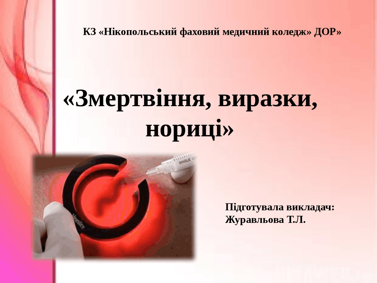 ЗМЕРТВІННЯ АНАТОМІЯ Конспекты лекций Правоведение Docsity