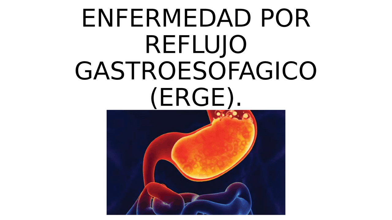 Enfermedad por reflujo gastroesofágico (ERGE): causas, síntomas ...