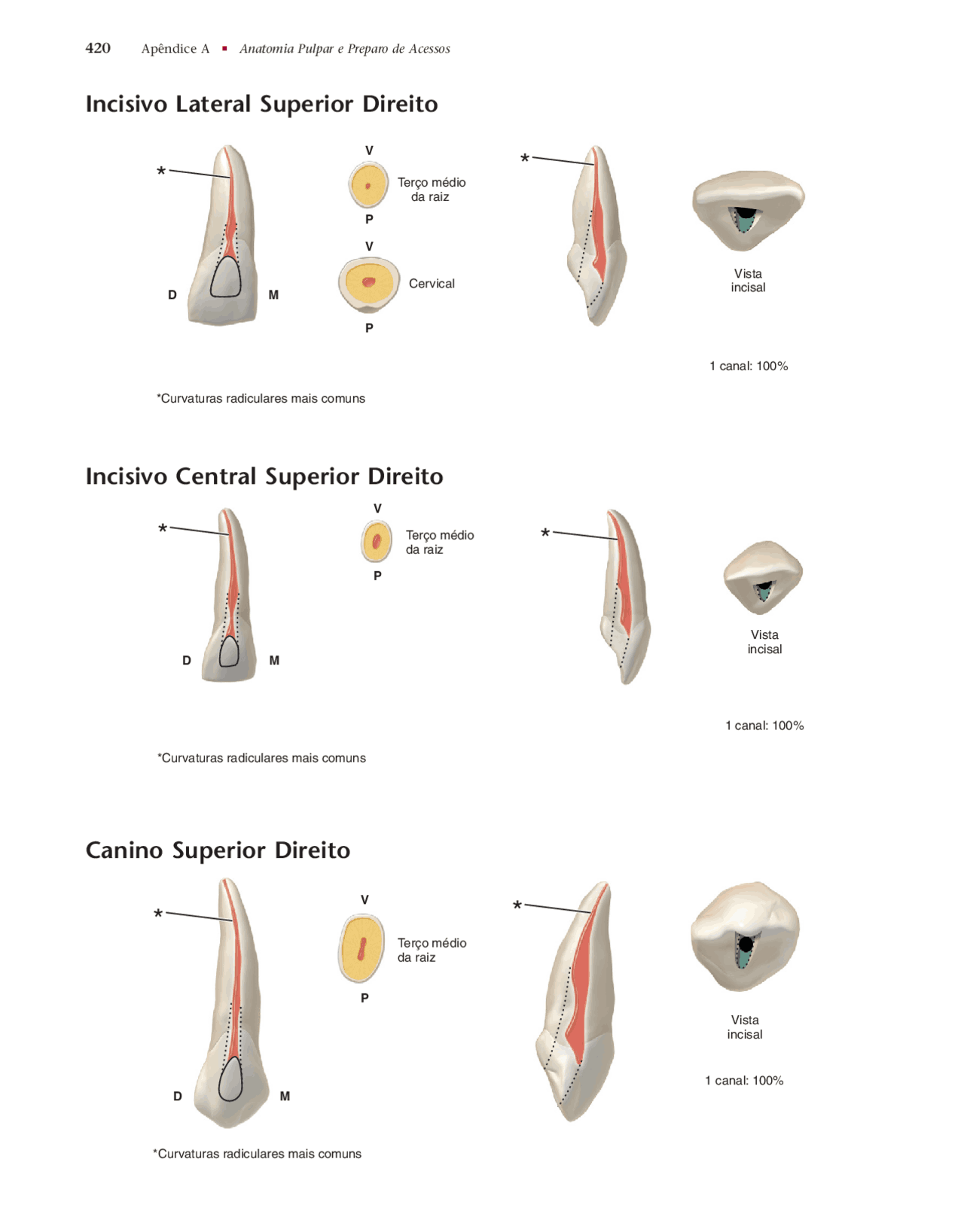 Anatomia Pulpar e Preparo de Acessos em Dentes: Curvaturas Radiculares ...