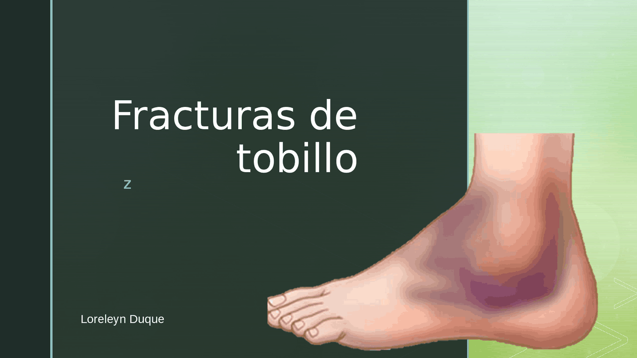 Fracturas de Tobillo: Clasificación y Diagnóstico | Resúmenes de Humanidades y Ciencias Sociales ...