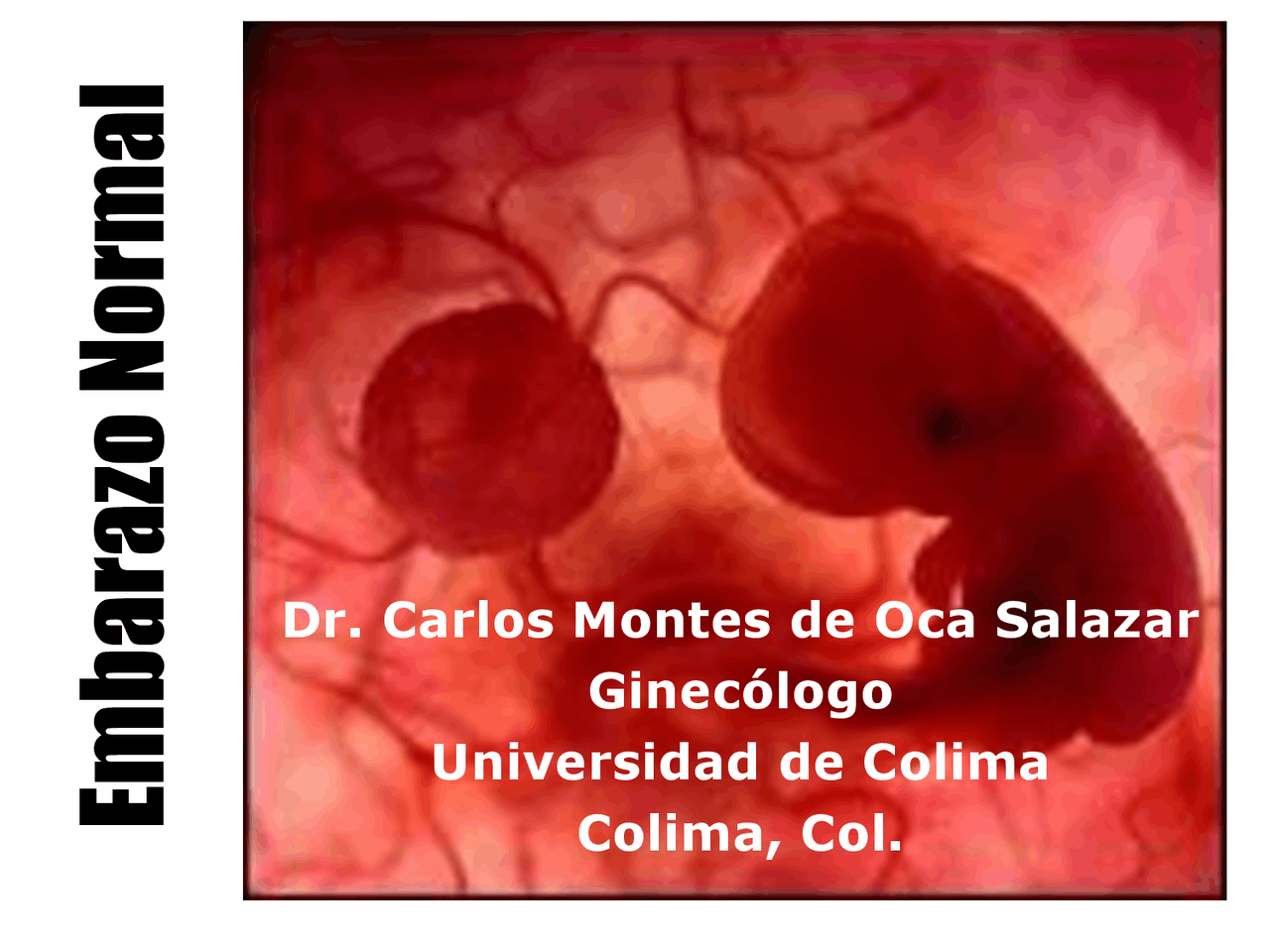 Embarazo Normal: Cuidados y Diagnóstico - Prof. Aguilar del Carpio ...