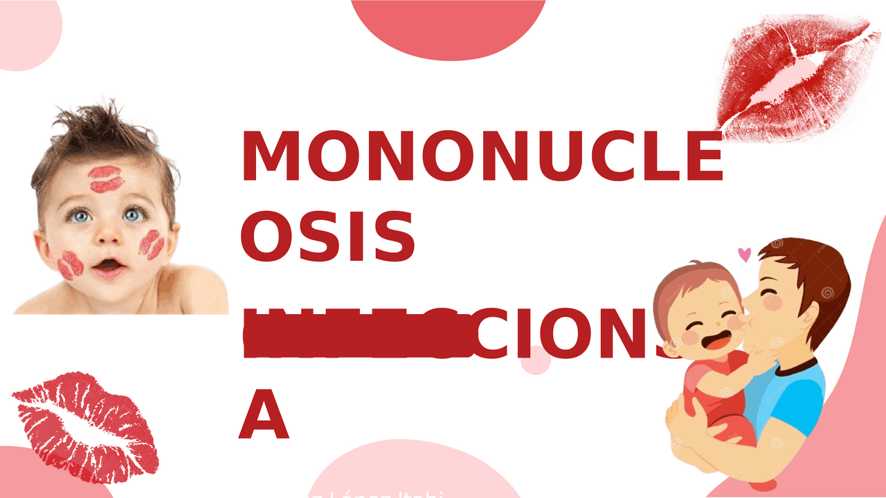 Enfermedad infecciosa comúnmente conocida como mononucleosis o ...