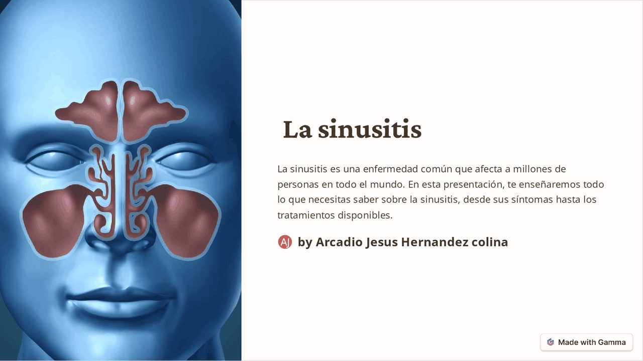 Sinusitis: Causas, Síntomas y Tratamientos | Diapositivas de Anatomía Aplicada | Docsity