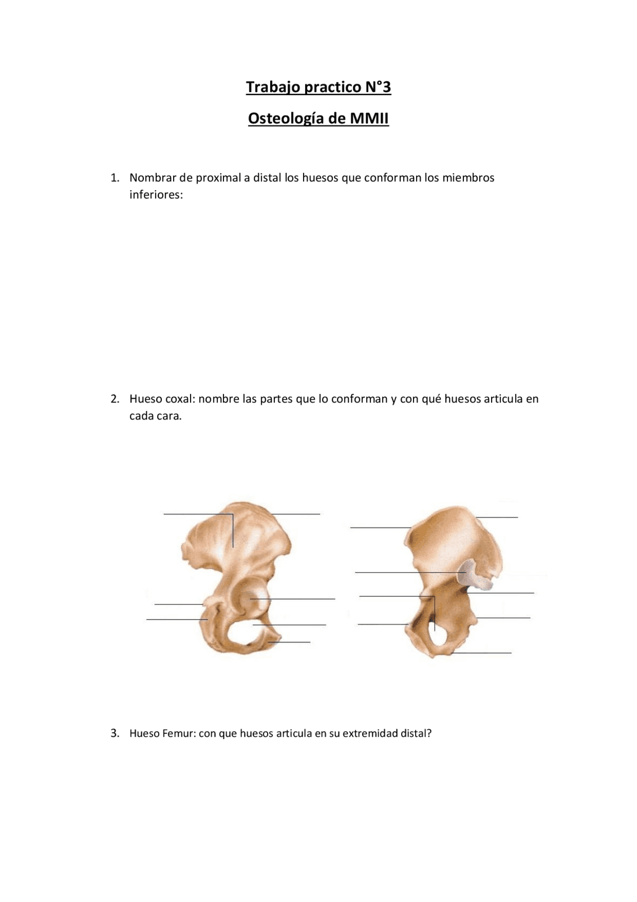 femur tibia y perone | Guías, Proyectos, Investigaciones de Anatomía | Docsity