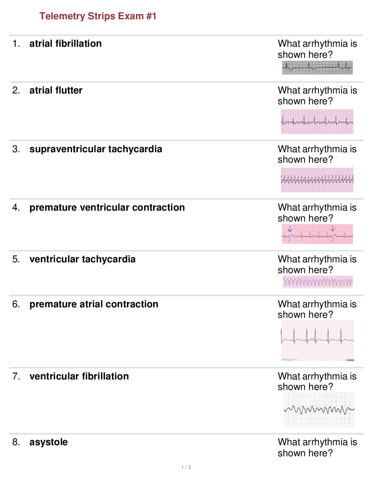 Telemetry Strips Exam: Recognizing and Managing Arrhythmias | Exams ...