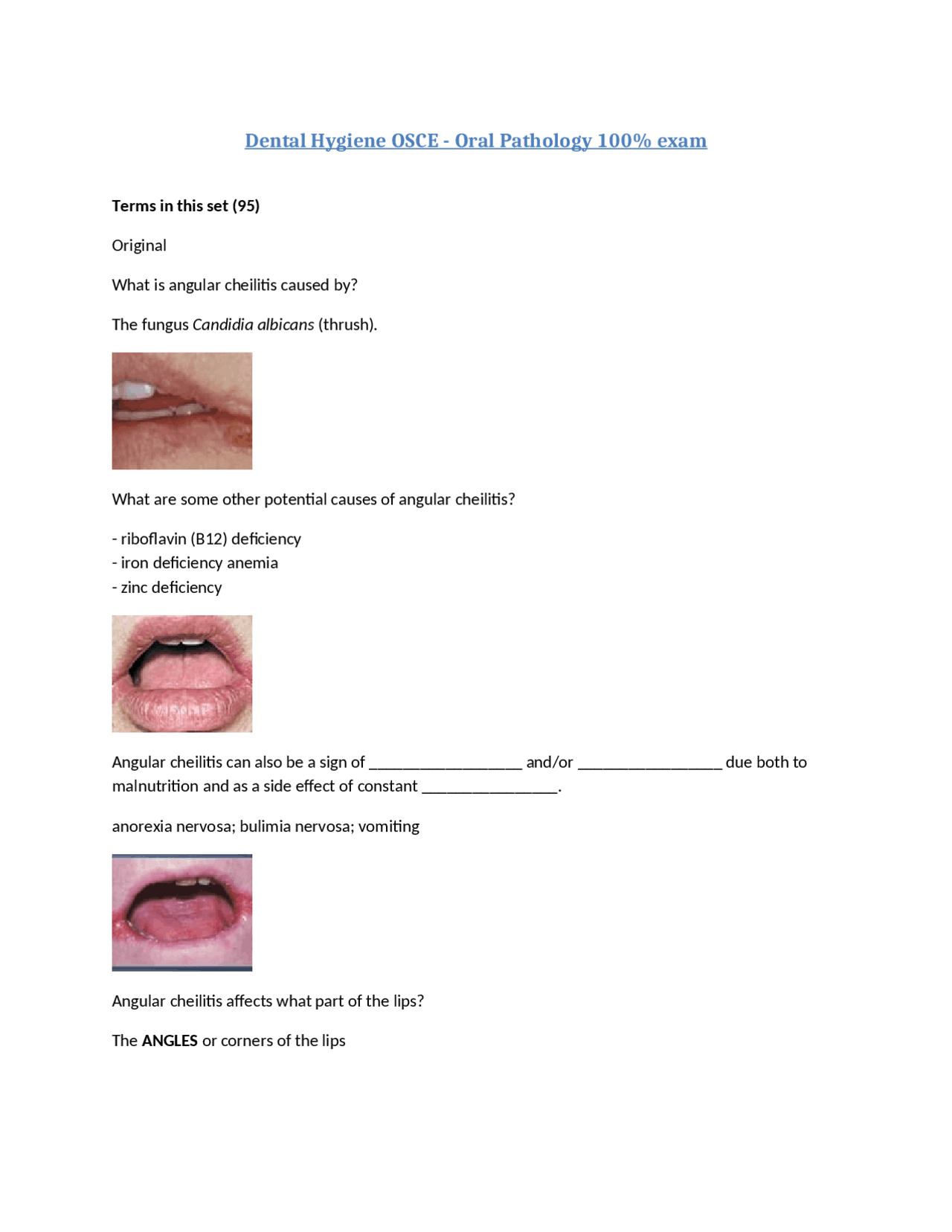 Dental Hygiene OSCE - Oral Pathology 100% exam | Exams Dentistry | Docsity