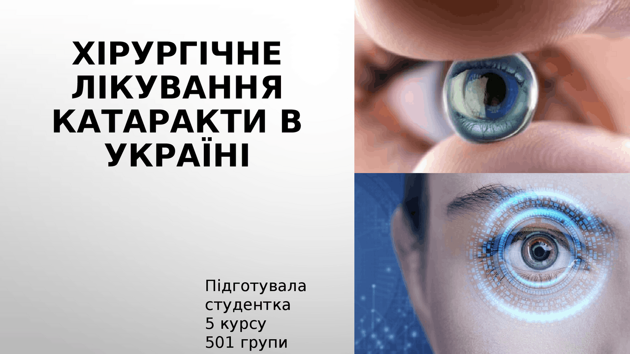 Хірургічне лікування катаракти в Україні | Презентации Офтальмология ...