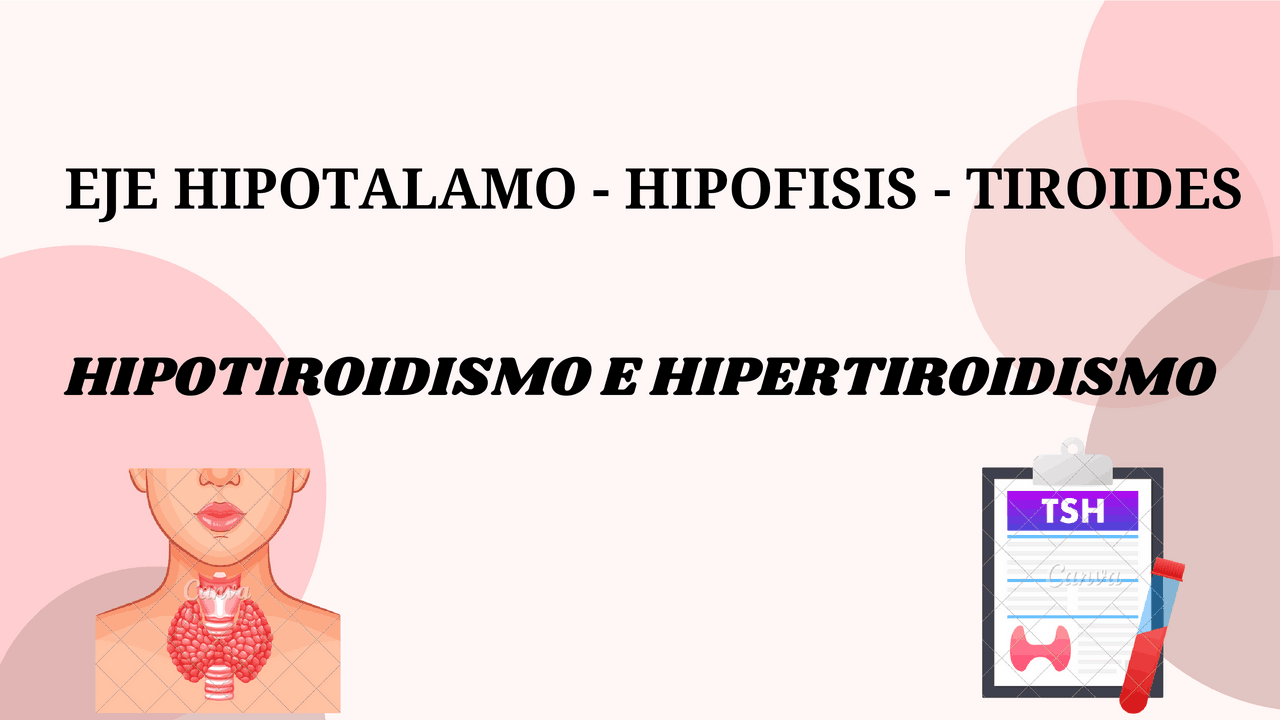 Presentación de hipotiroidismo e hipertiroidismo | Diapositivas de Endocrinología | Docsity