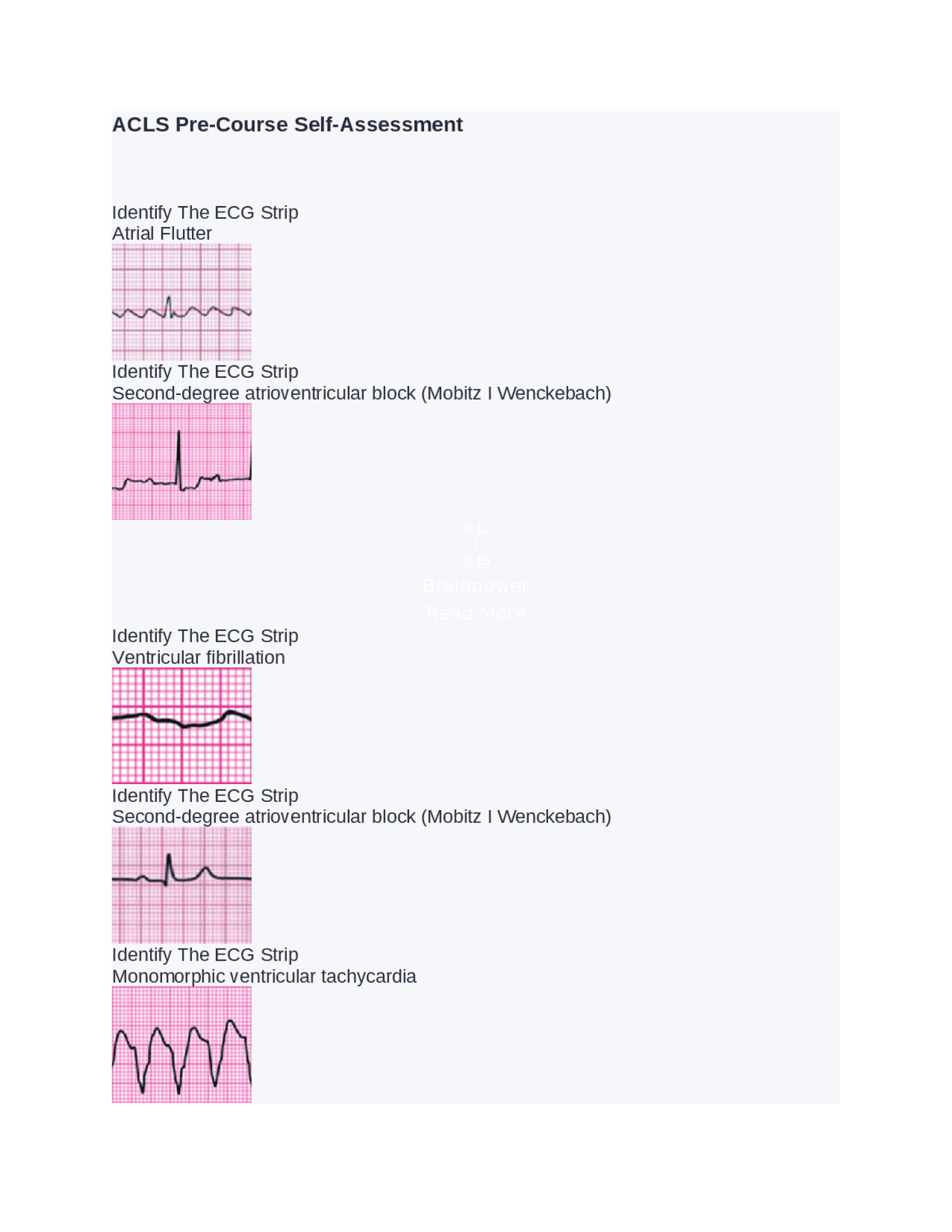 ACLS Pre-Course Self-Assessment: Identifying and Managing Cardiac ...