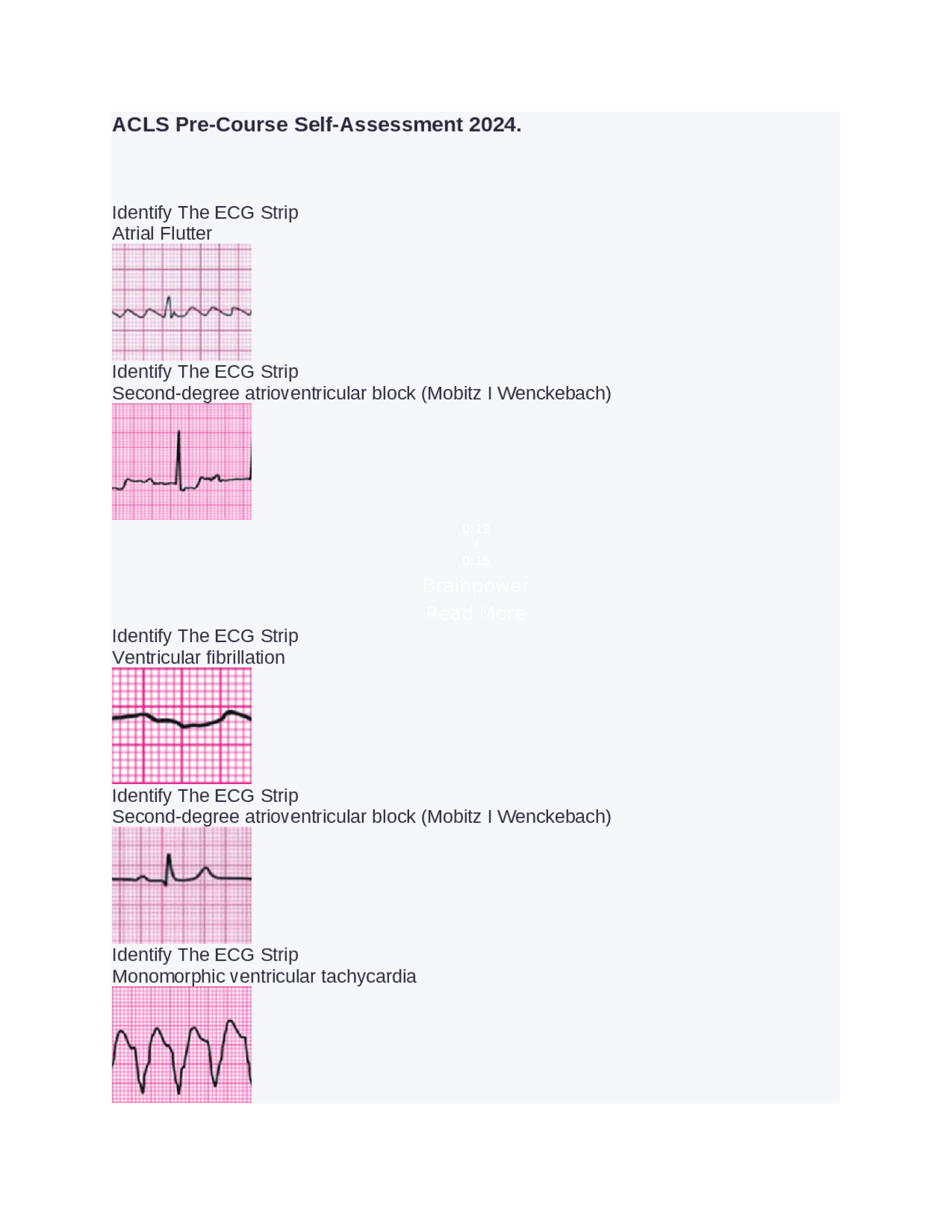 ECG Interpretation and Treatment Guidelines for Cardiac Arrest and ...