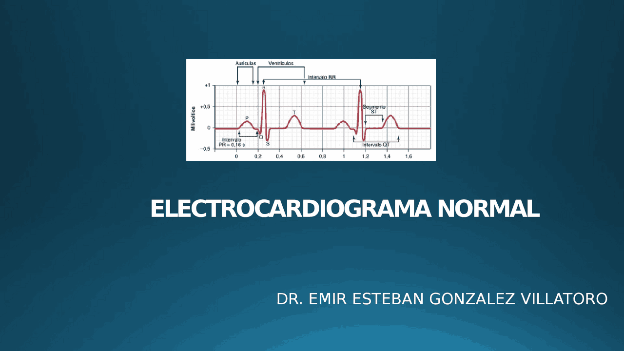 Electrocardiograma normal | Esquemas y mapas conceptuales de Cardiología | Docsity