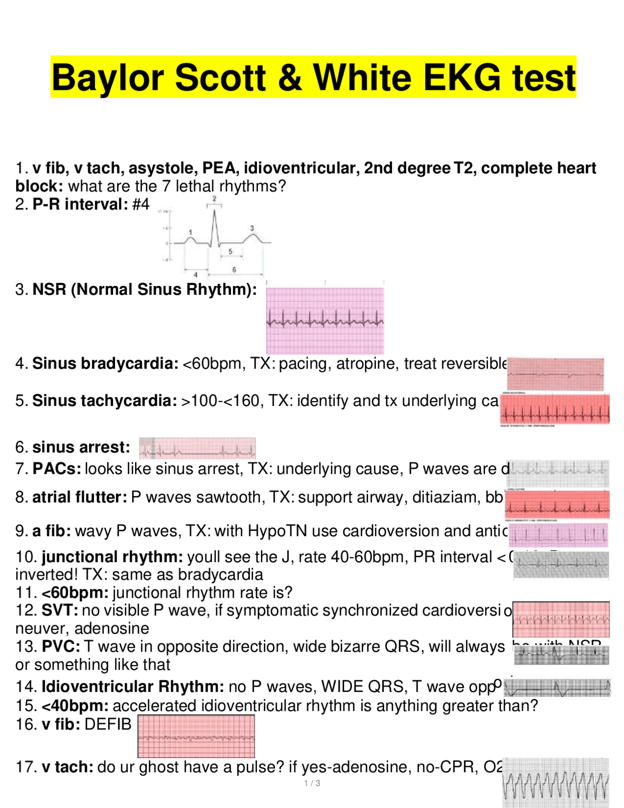 Understanding Electrocardiogram (EKG) Test: Recognizing Various Heart ...