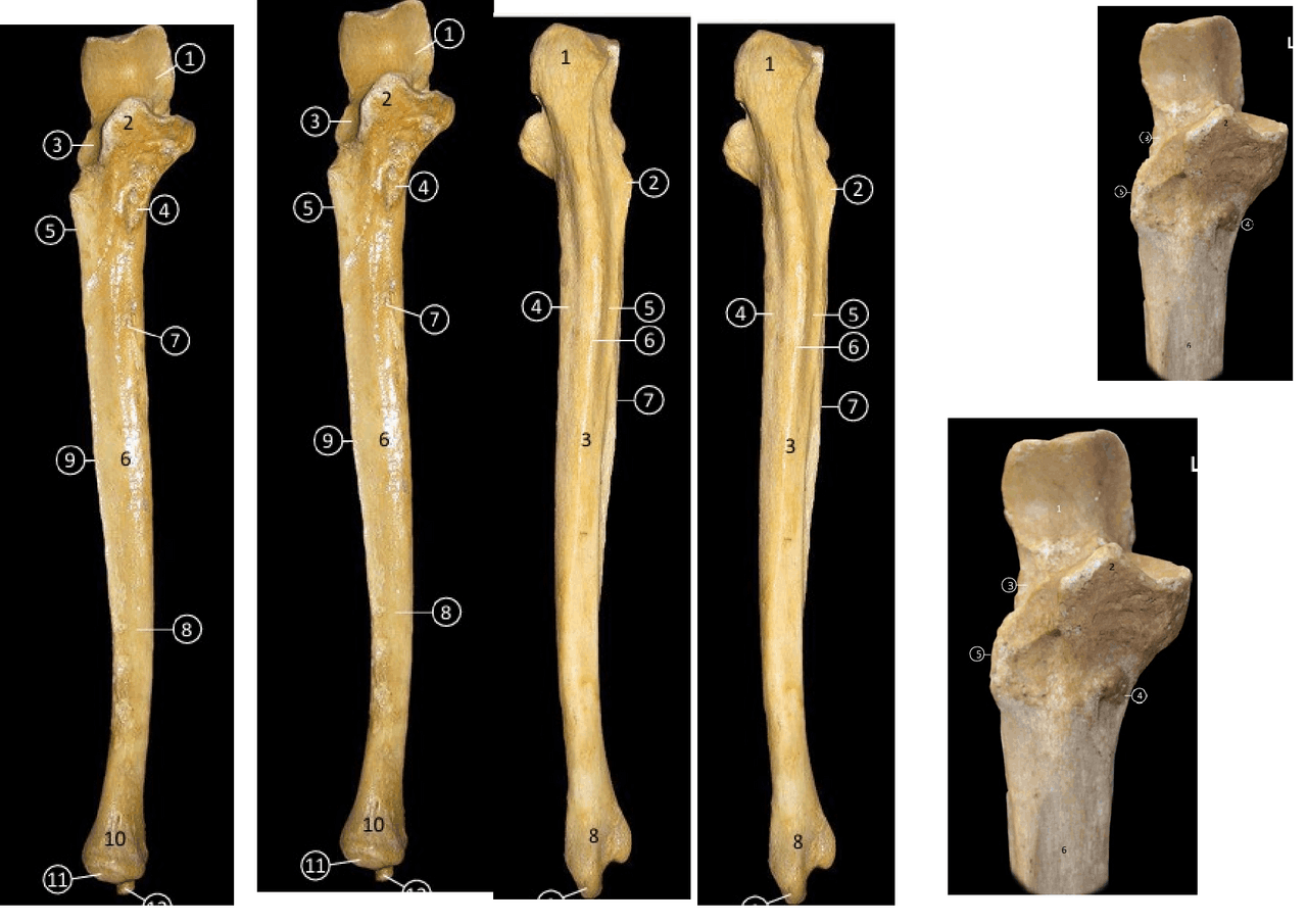 anatomia cubito una imagen para descargar | Esquemas y mapas ...