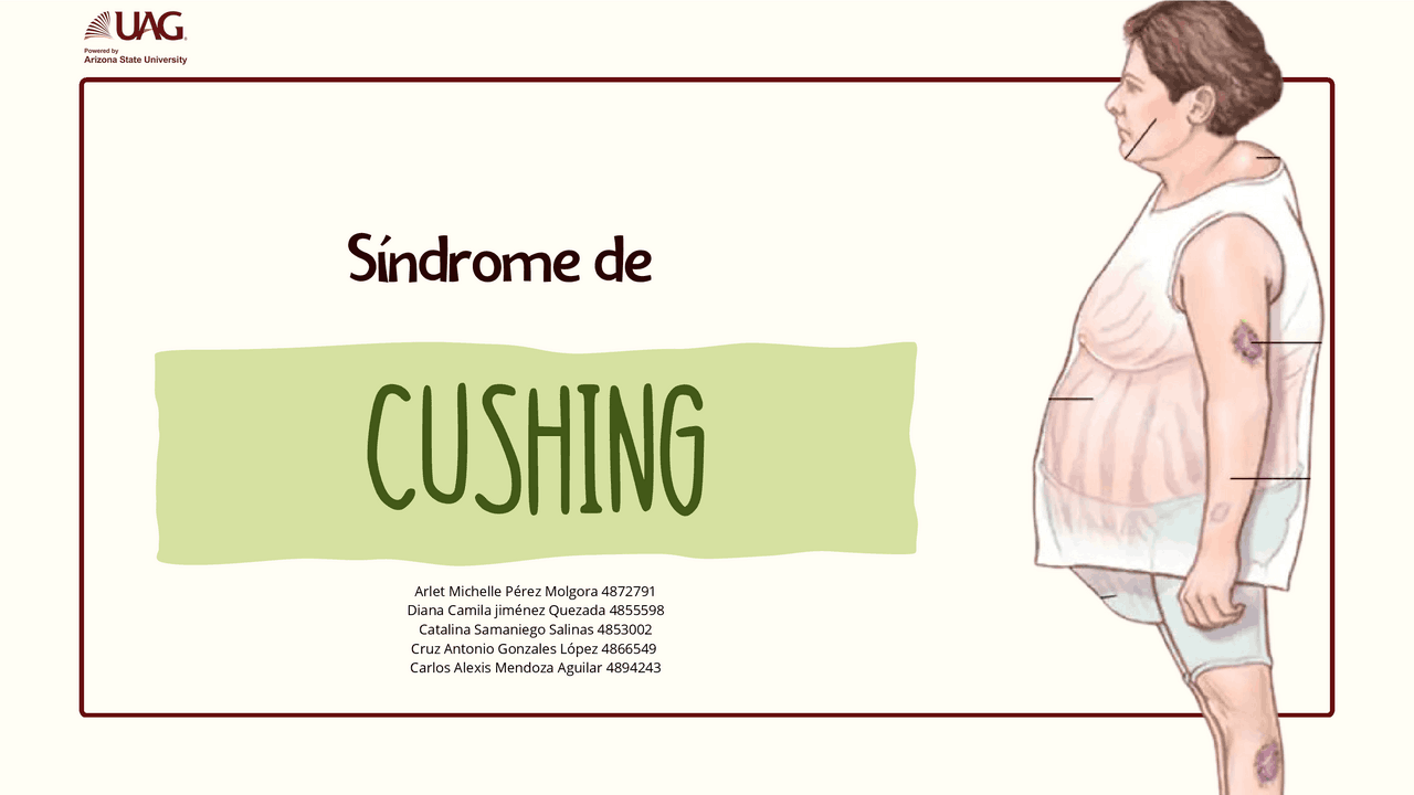 Síndrome de Cushing: Causas, Fisiopatología y Diagnóstico | Diapositivas de Fisiopatología | Docsity