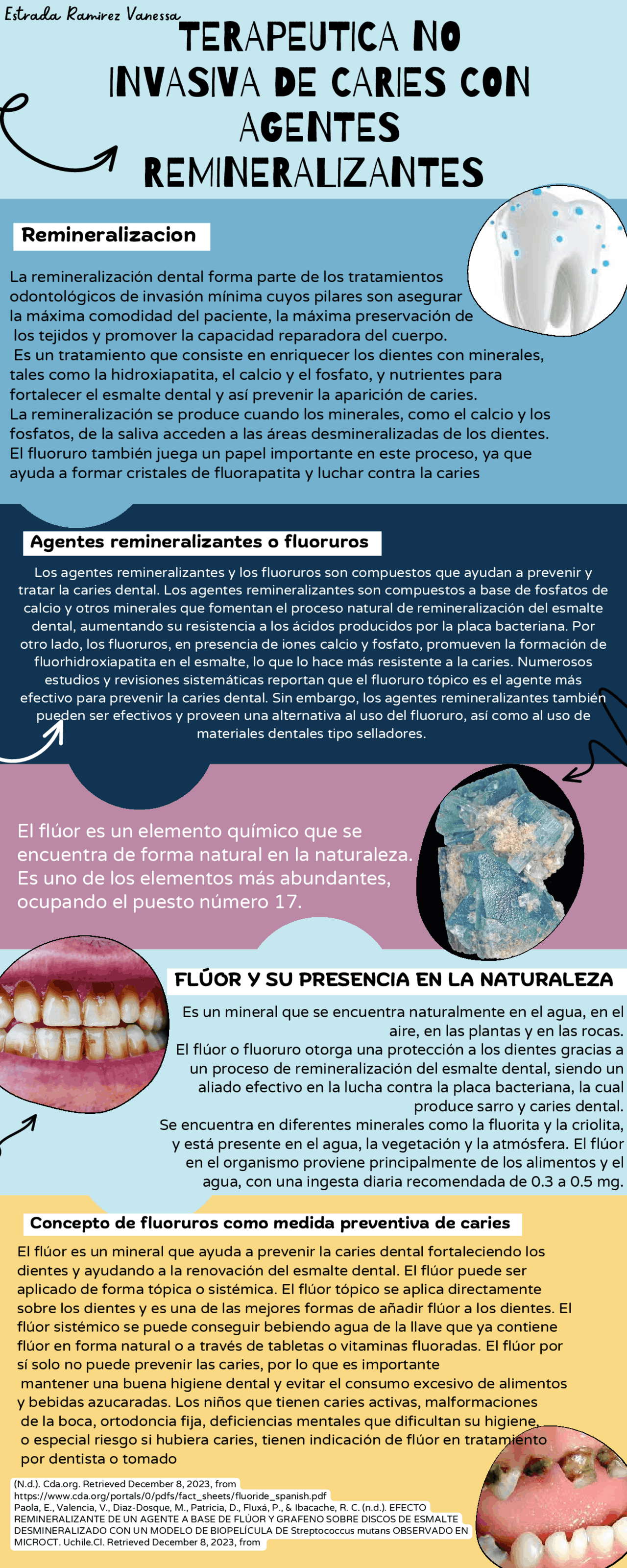 Infografia sobre calculo dental | Esquemas y mapas conceptuales de ...
