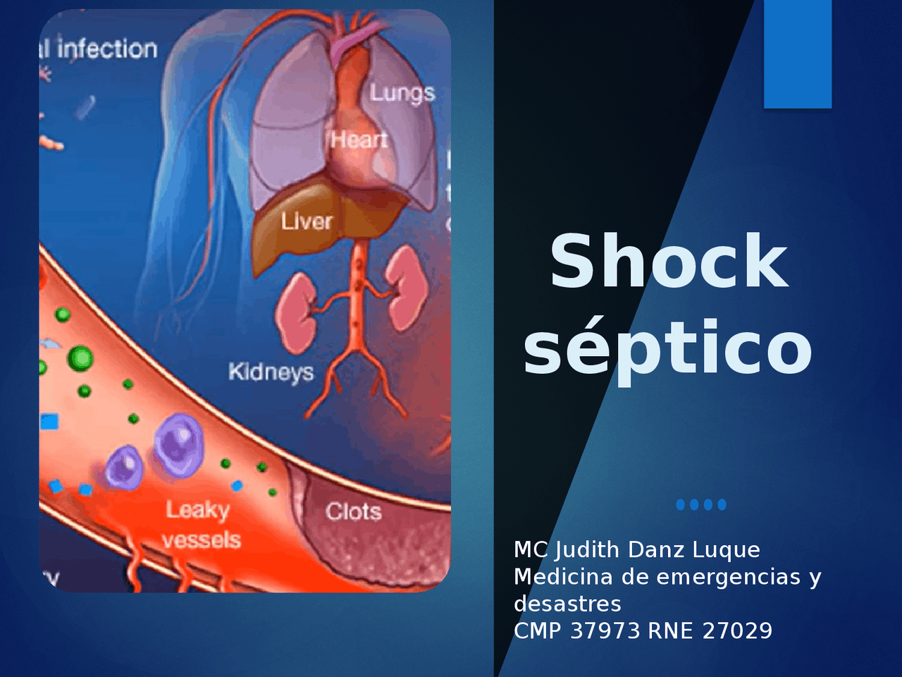 shock septico y sepsis | Diapositivas de Gestión Estratégica | Docsity