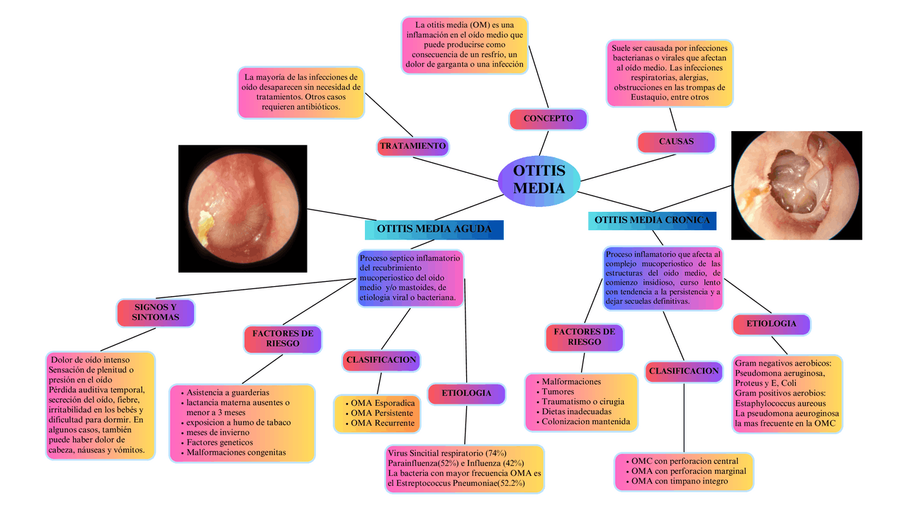 Otitis Media: Tipos, Causas y Tratamiento | Resúmenes de Ciencias de la ...