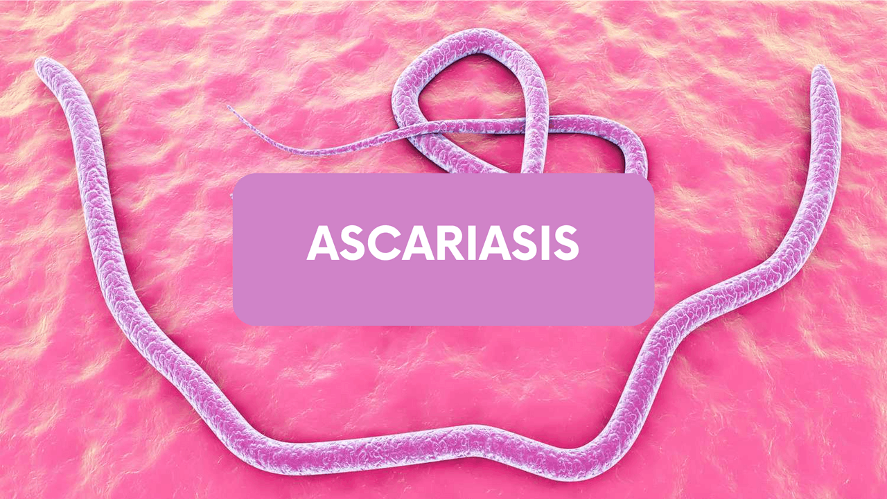 ASCARIASIS - PARASITOLOGIA | Diapositivas de Parasitología | Docsity