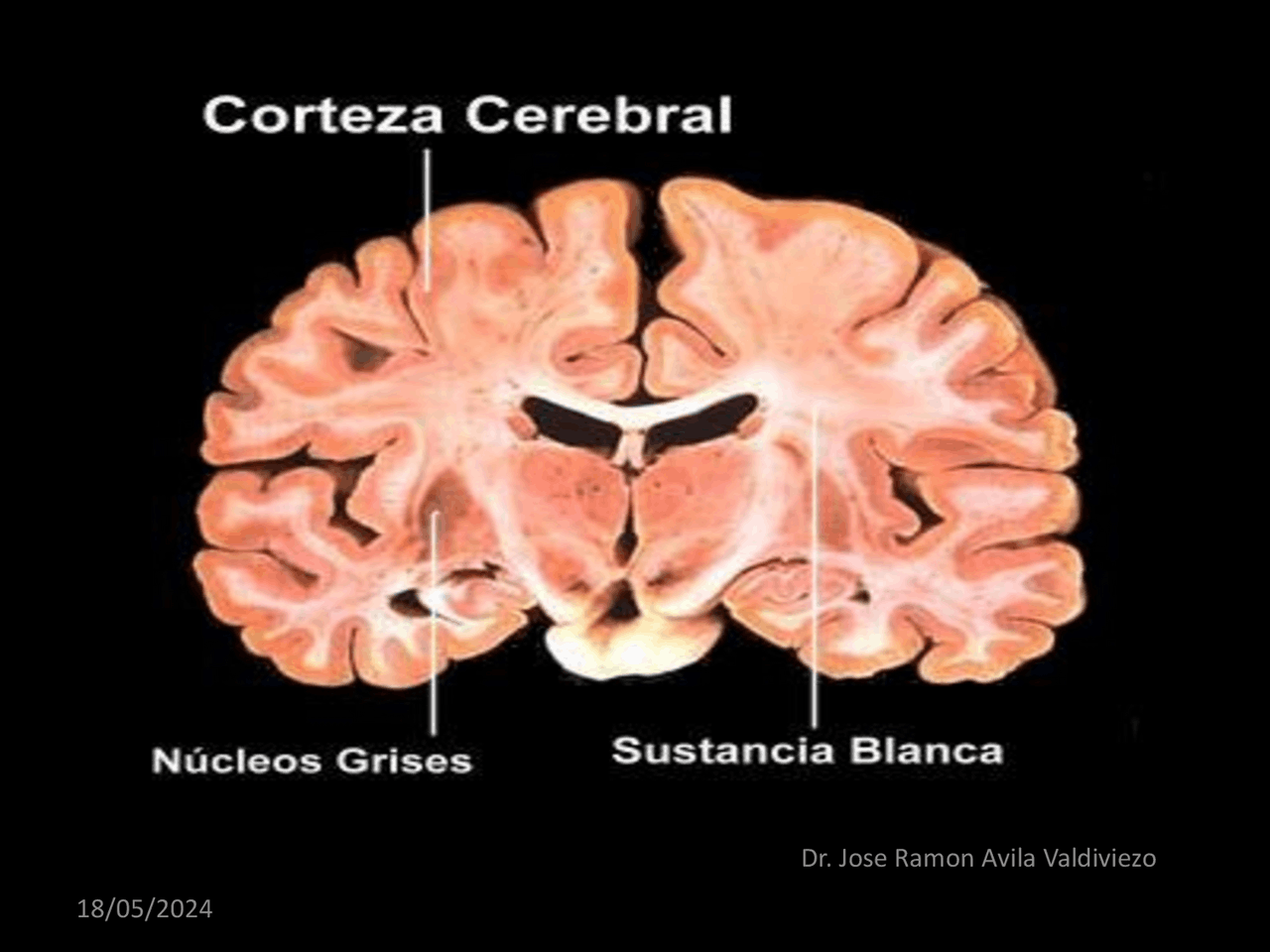 histologia de corteza cerebral | Diapositivas de Histología | Docsity