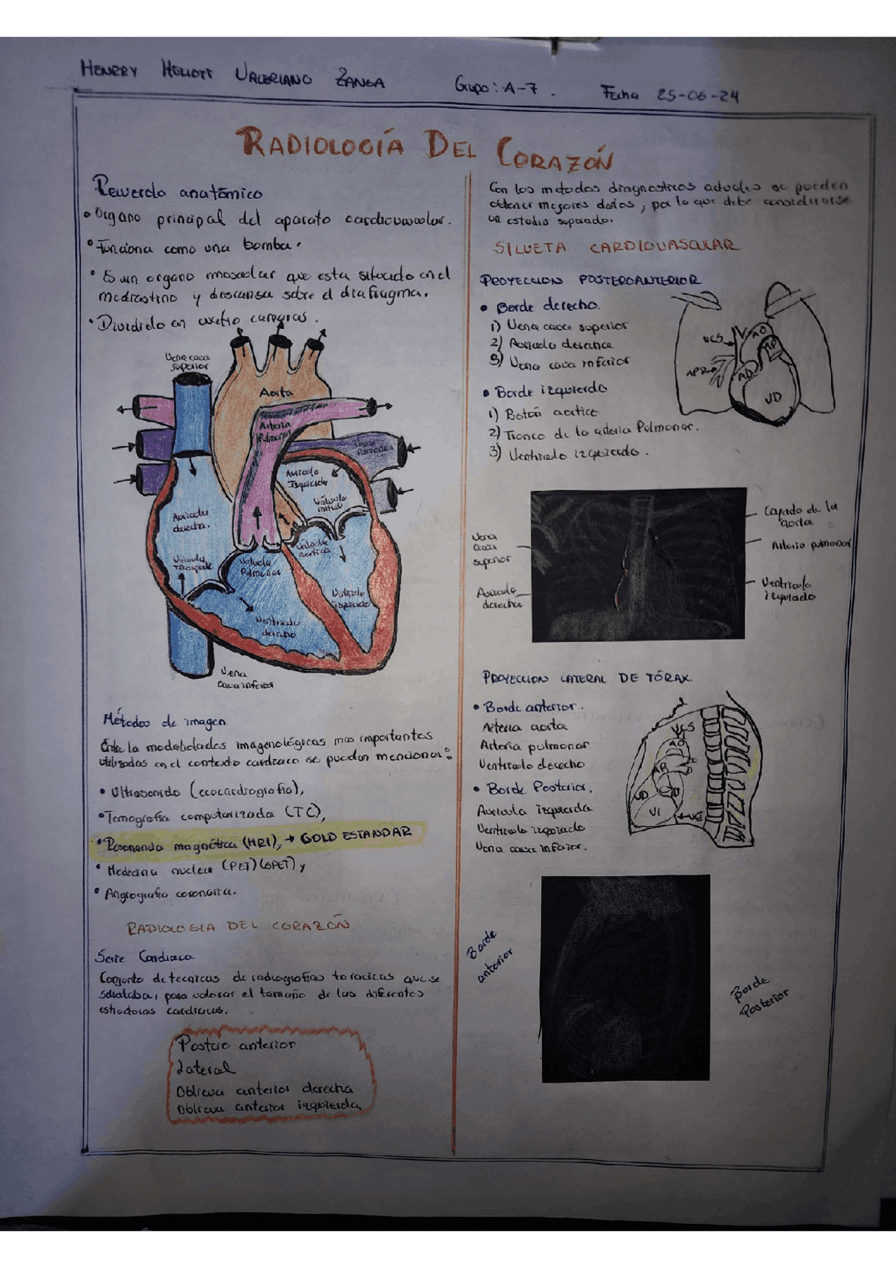 Radiología de corazón | Apuntes de Radiología | Docsity