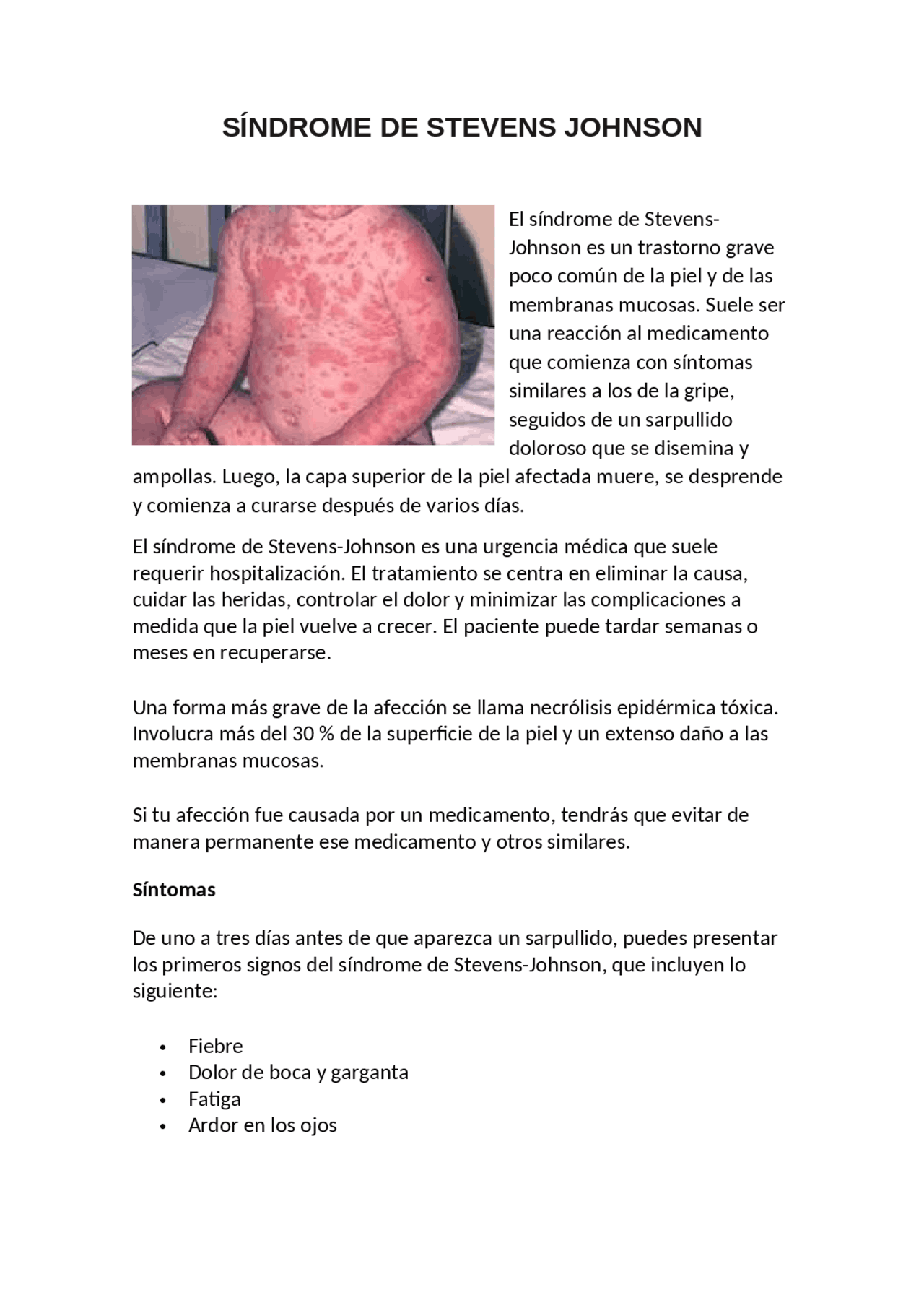 SÍNDROME DE STEVENS JOHNSON | Resúmenes de Farmacología | Docsity