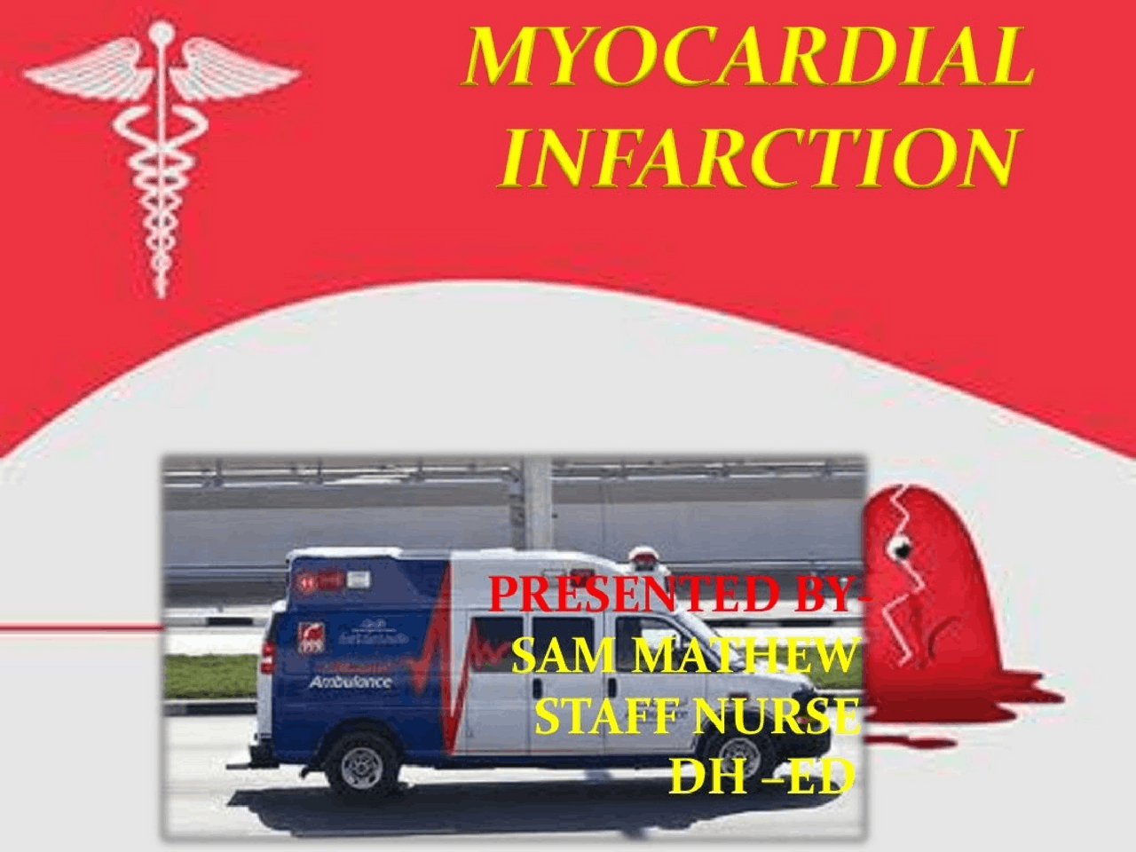 MYOCARDIAL INFARCTION -summary notes | Study Guides, Projects, Research ...