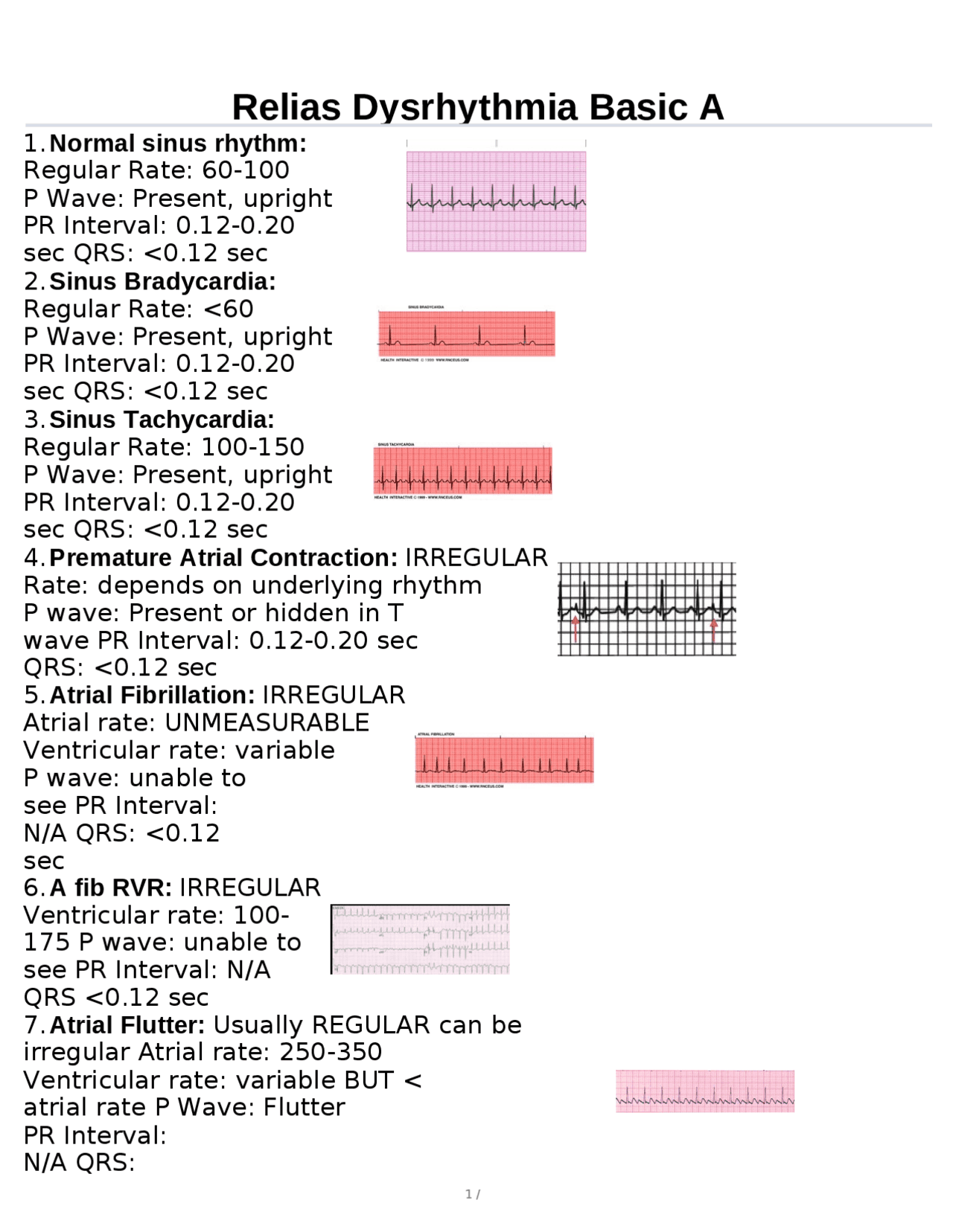 Dysrhythmia Basics: A Comprehensive Guide to Understanding Heart Rhythms | Study Guides ...