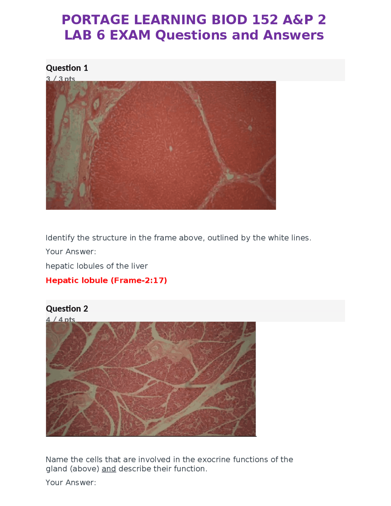 PORTAGE LEARNING BIOD 152 A&P 2 LAB 6 EXAM Questions and Answers | Exams Nursing | Docsity