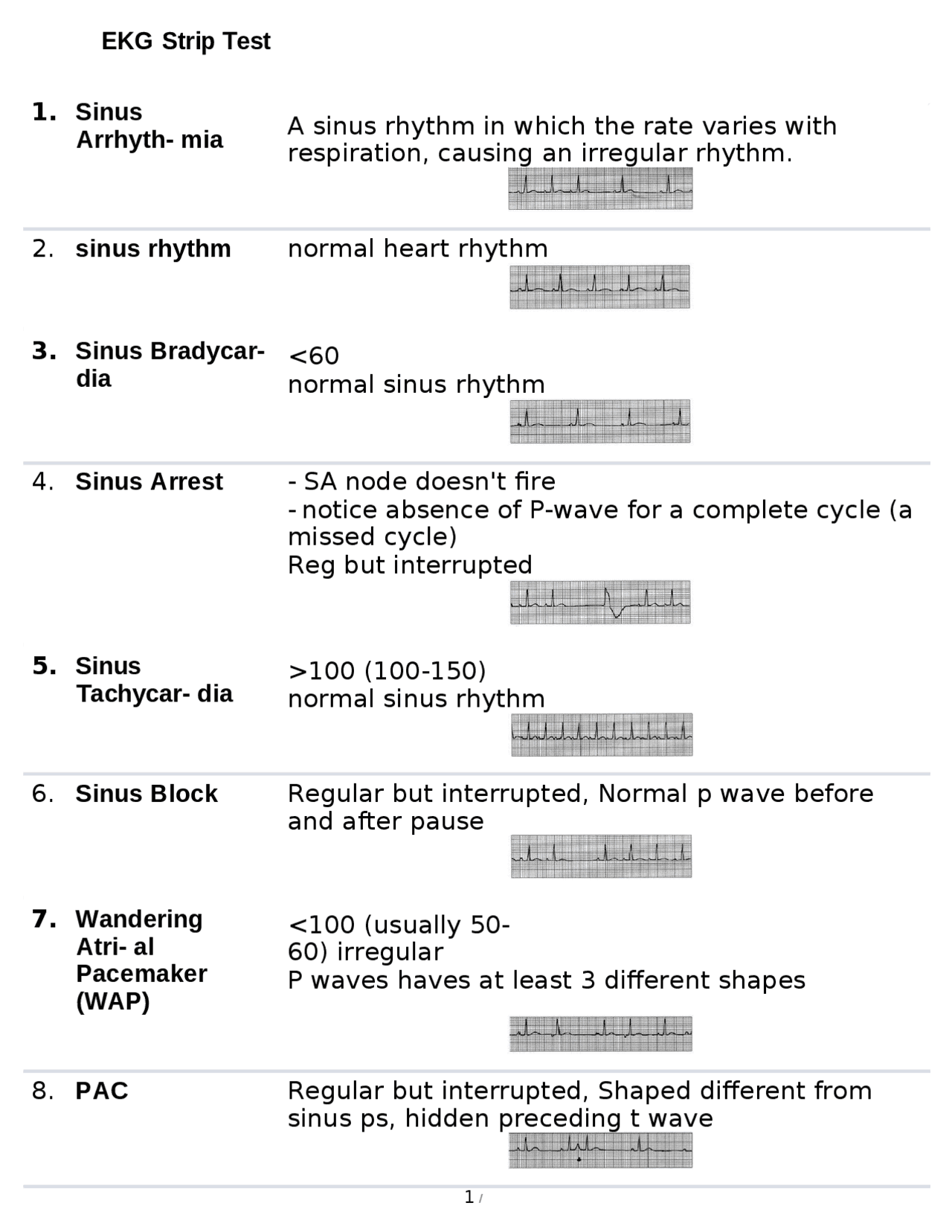 EKG Strip Test: Understanding Heart Rhythms | Exams Nursing | Docsity