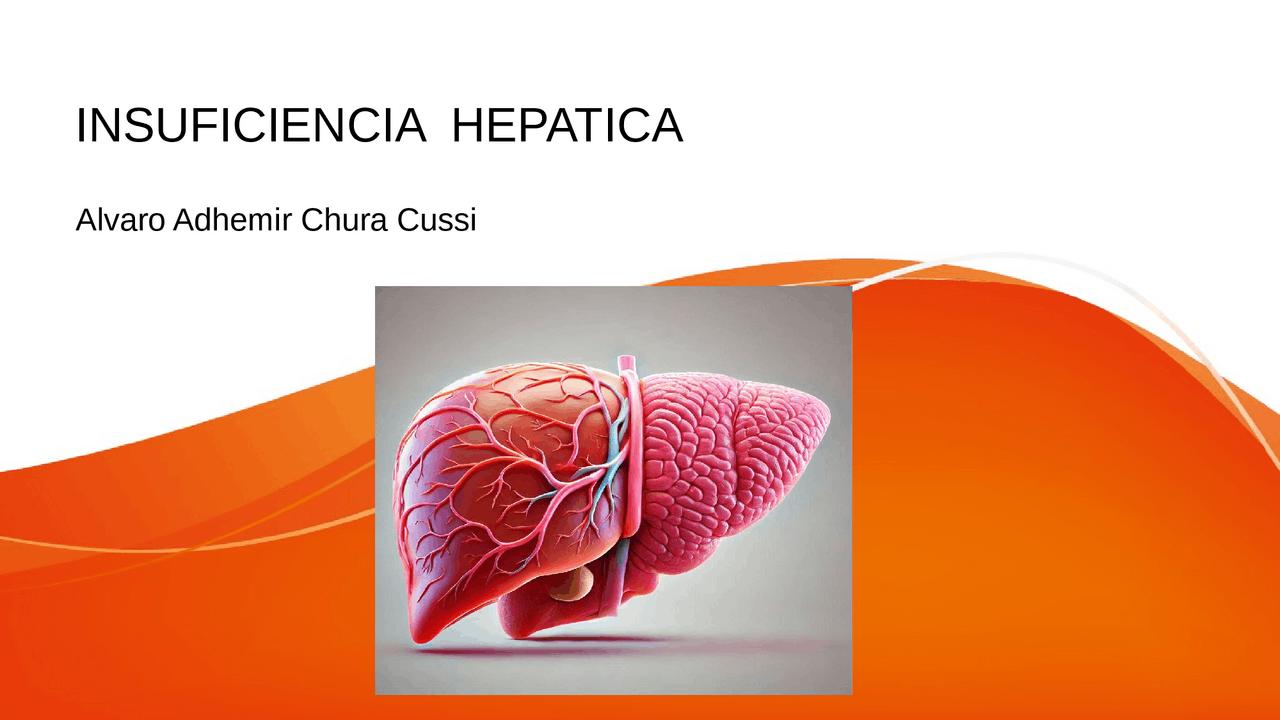 Insuficiencia Hepática: Causas, Síntomas, Diagnóstico y Tratamiento ...
