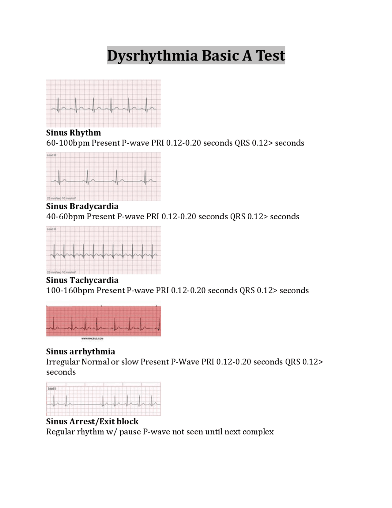 Dysrhythmia Basics: ECG Characteristics and Clinical Associations ...