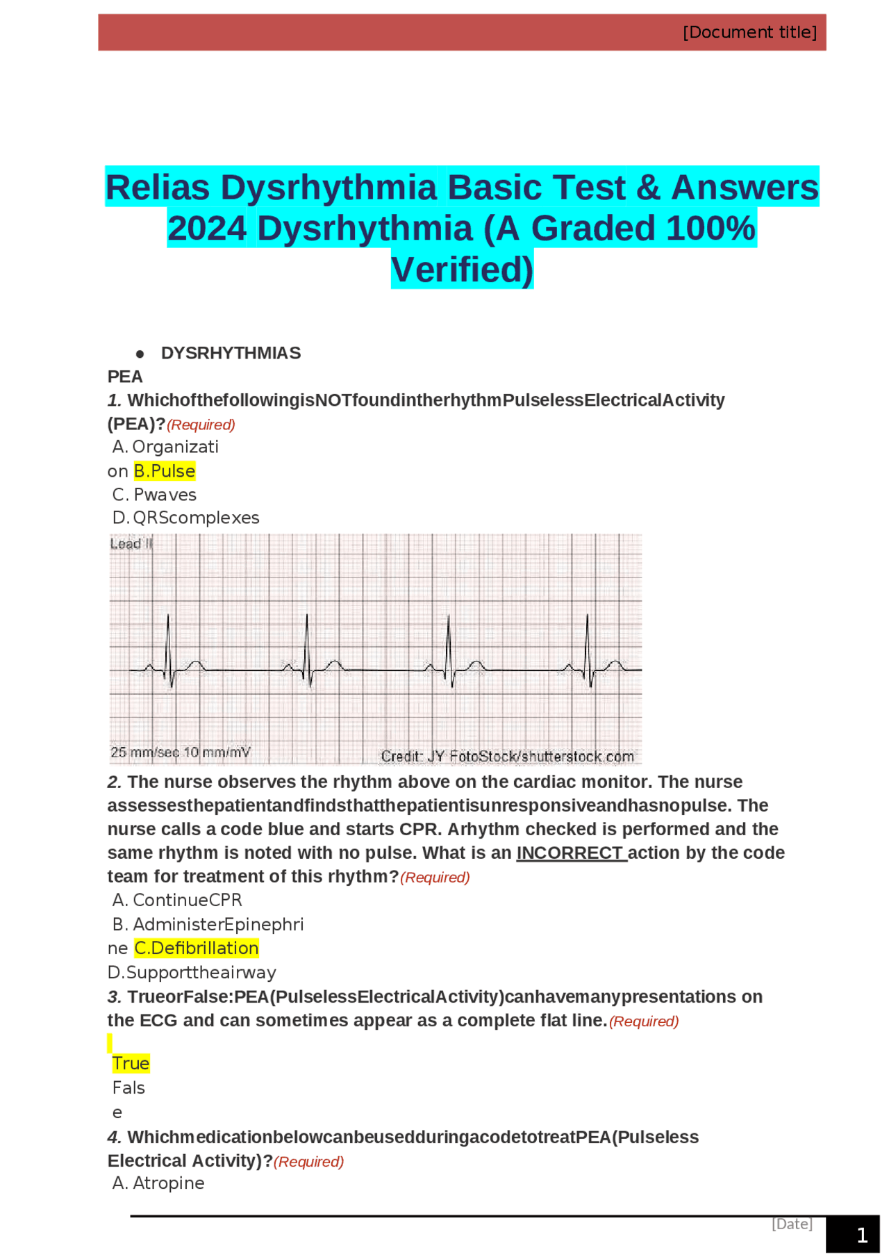Relias Dysrhythmia Basic Test & Answers: ECG Heart Rhythm Quiz ...
