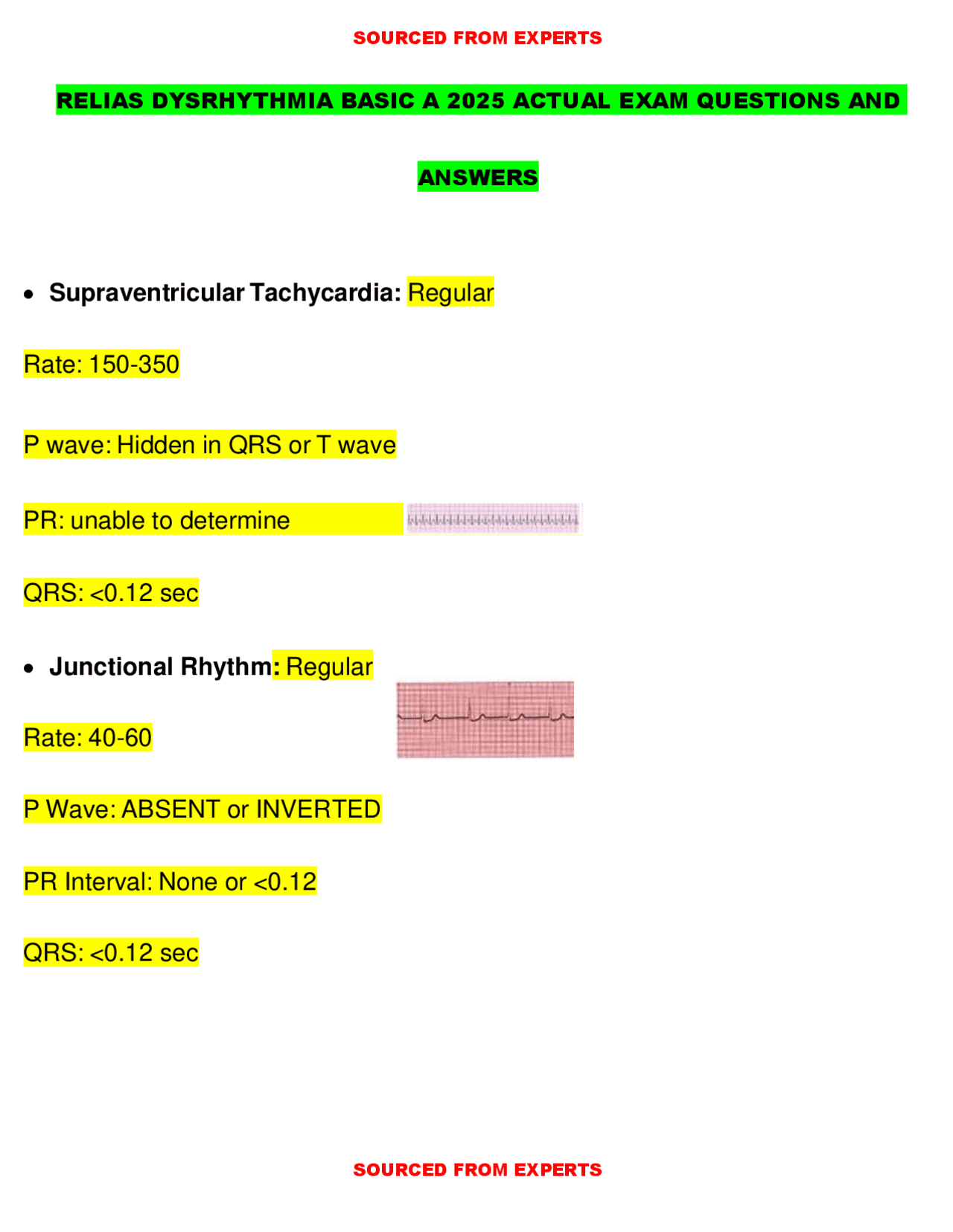 ECG Rhythms: A Comprehensive Guide with Definitions and Examples ...