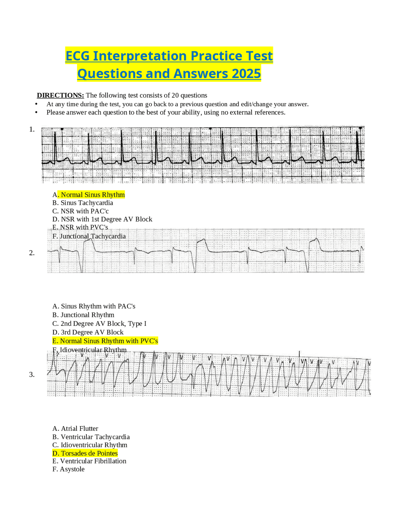 ECG Interpretation Practice Test: Questions and Answers 2025 | Exams ...
