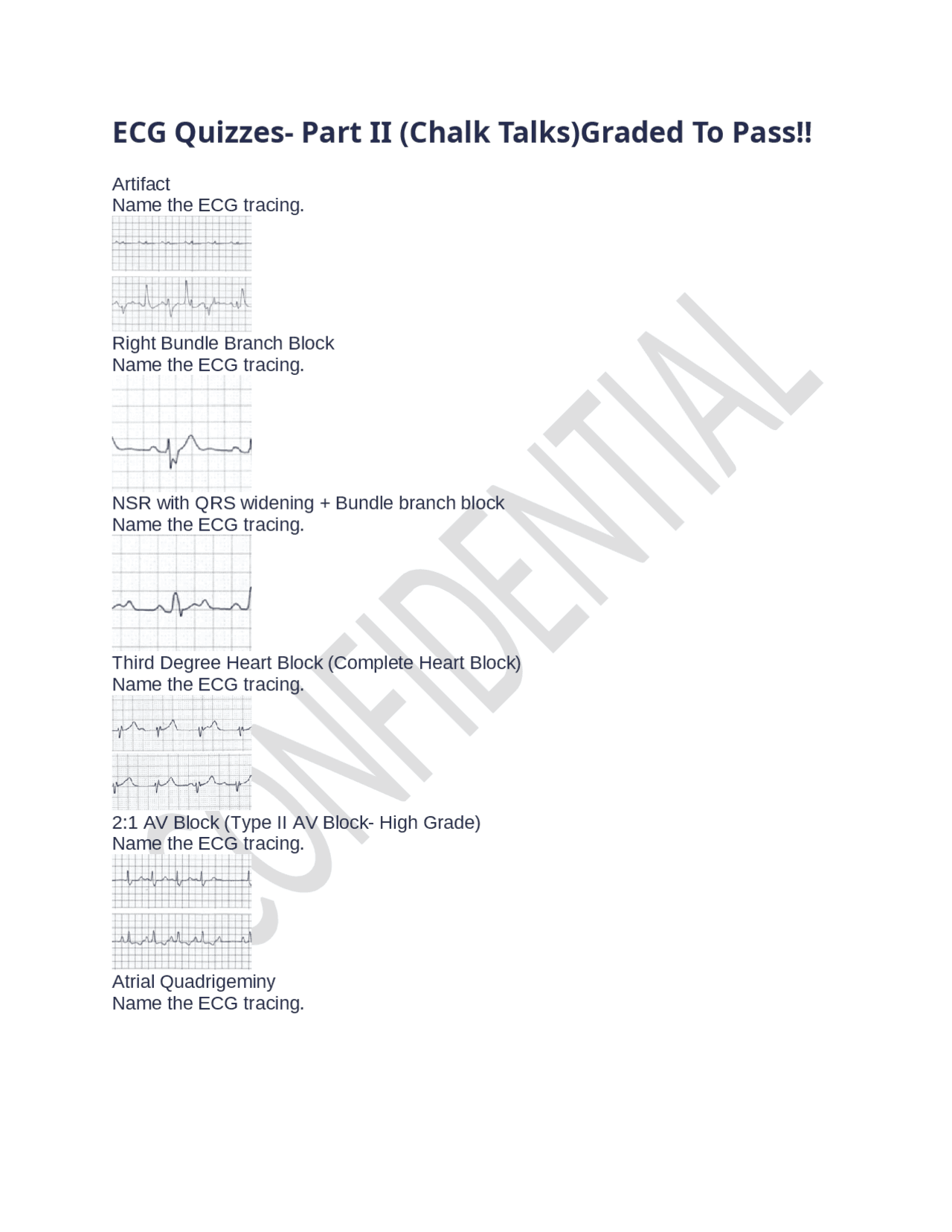 ECG Quizzes - Part II: Identifying ECG Tracings and Arrhythmias | Exams Nursing | Docsity
