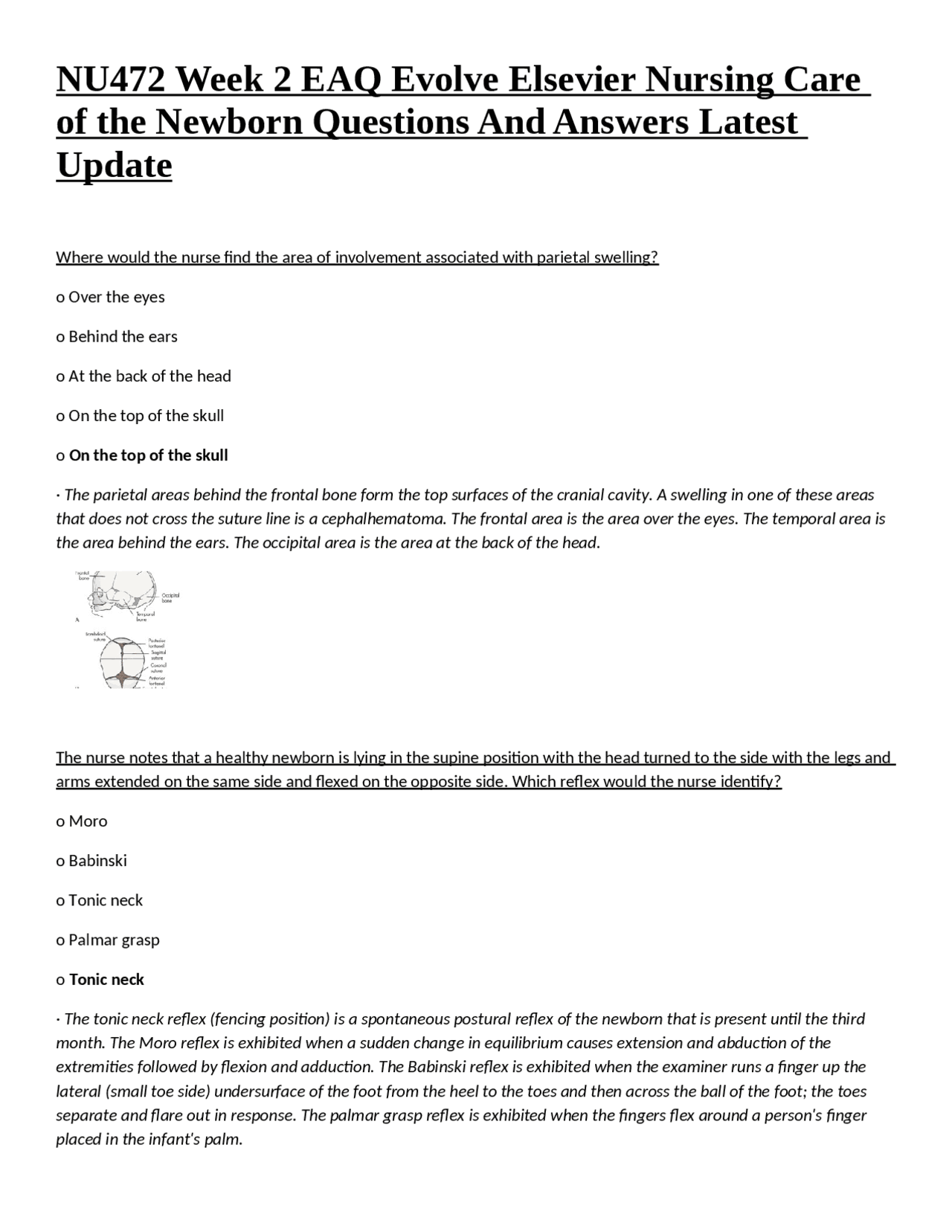 NU472 Week 2 EAQ Evolve Elsevier Nursing Care of the Newborn Questions ...