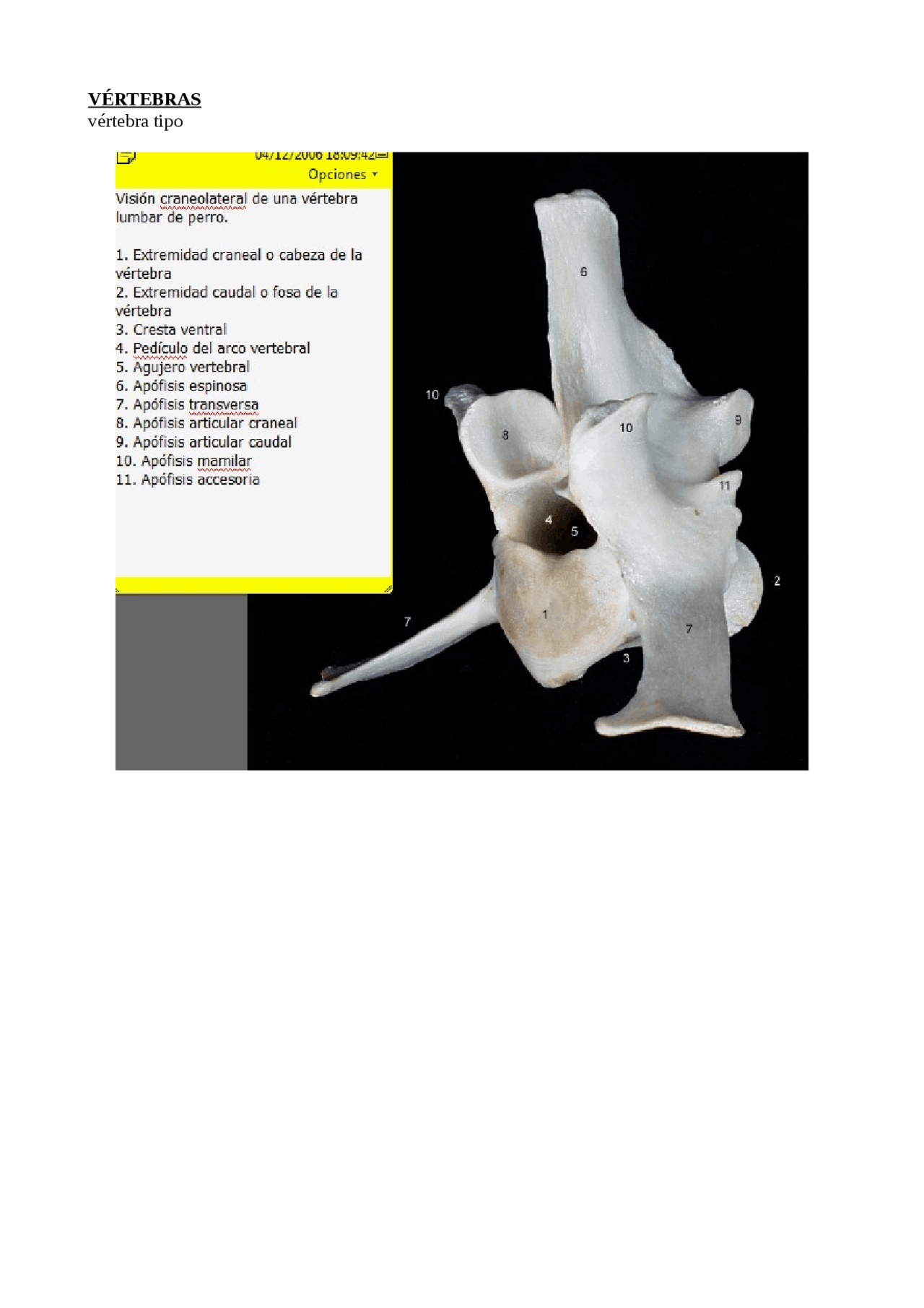 VERTEBRA TIPO - Apuntes de Anatomía - Docsity