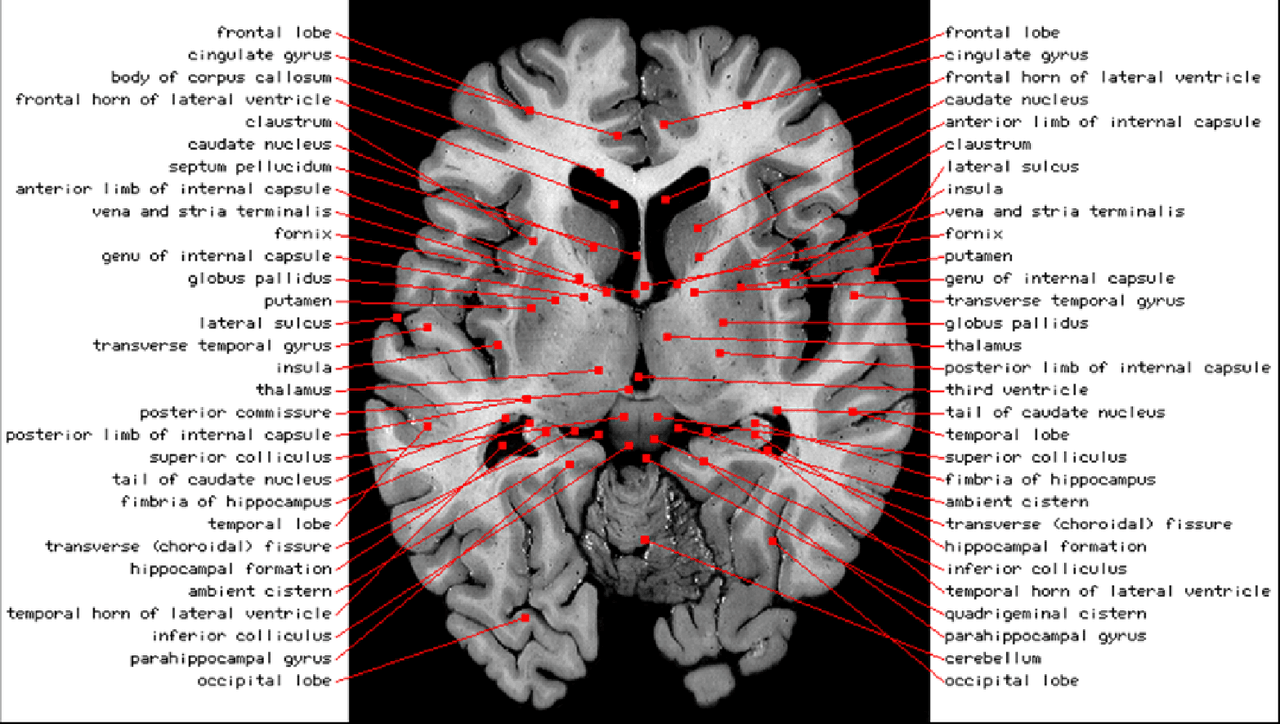 Corte horizontal cerebro - Apuntes de Psicología - Docsity