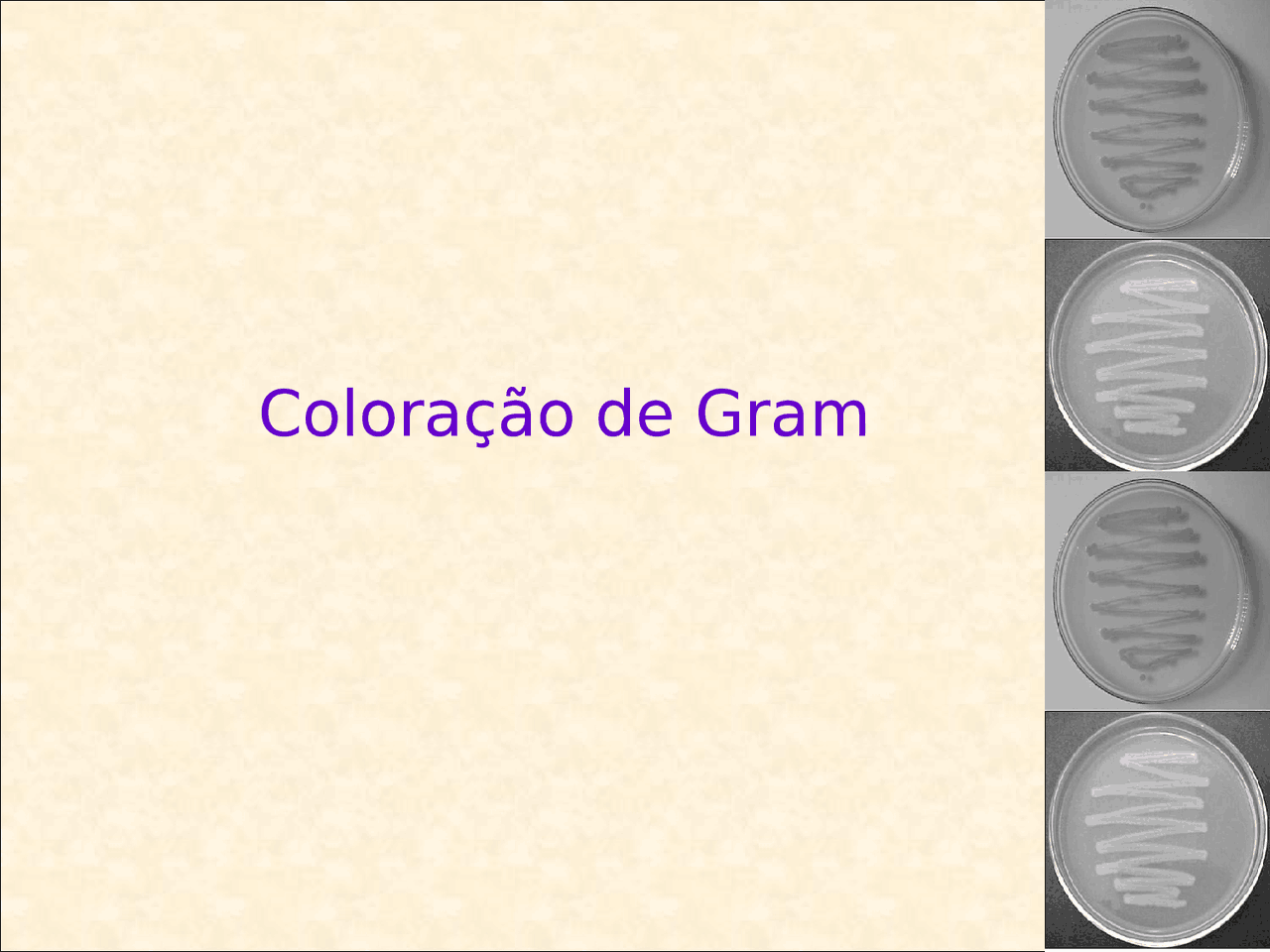 Coloração Gram Aula Aula Prática Coloração De Gram Docsity